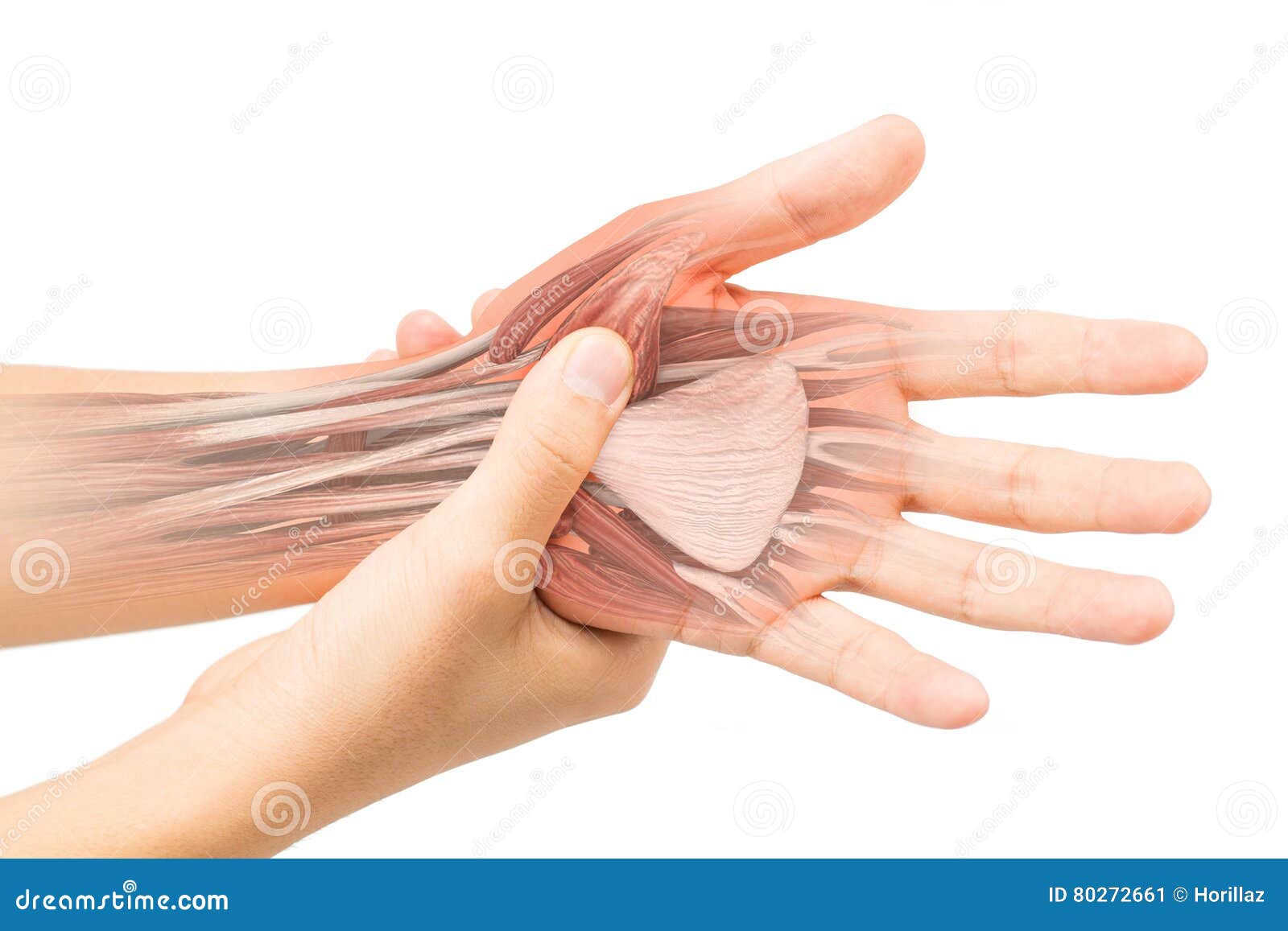 Hand muscle injury stock image. Image of pressure, body - 80272661