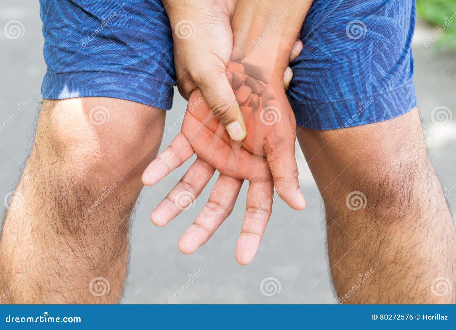 Hand muscle pain stock photo. Image of disease, median - 80272576