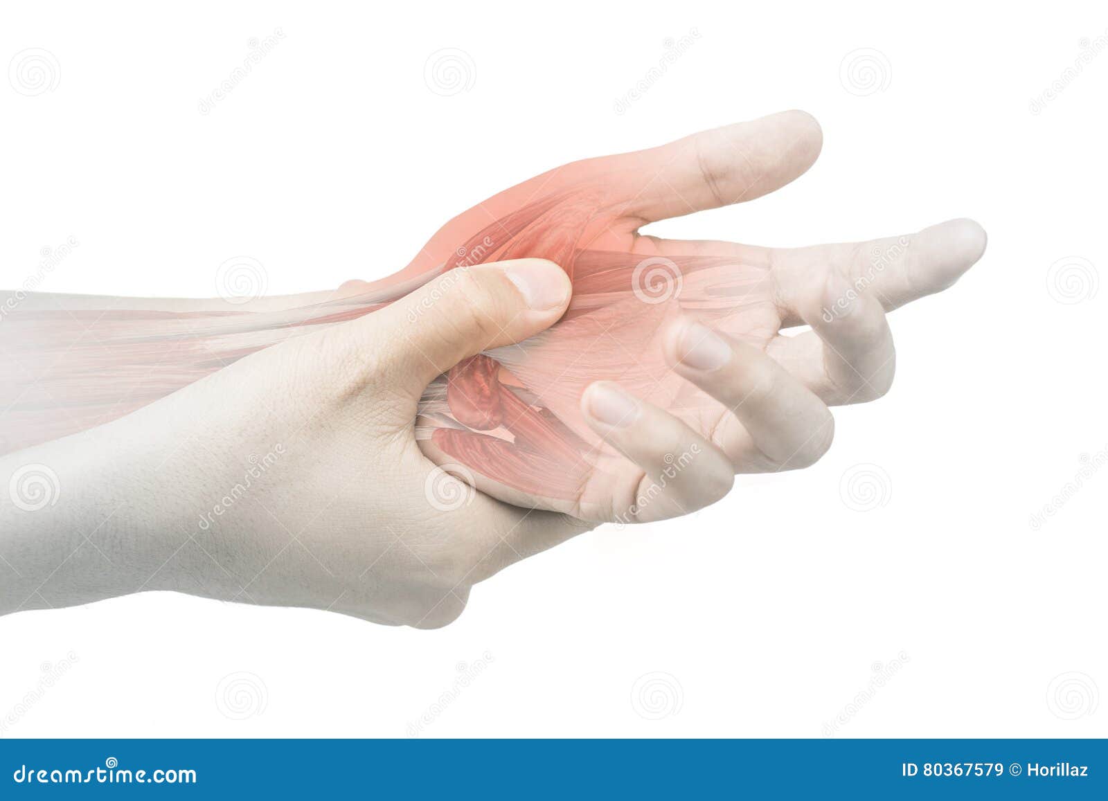 Hand muscle pain stock image. Image of muscle, extensor - 80367579