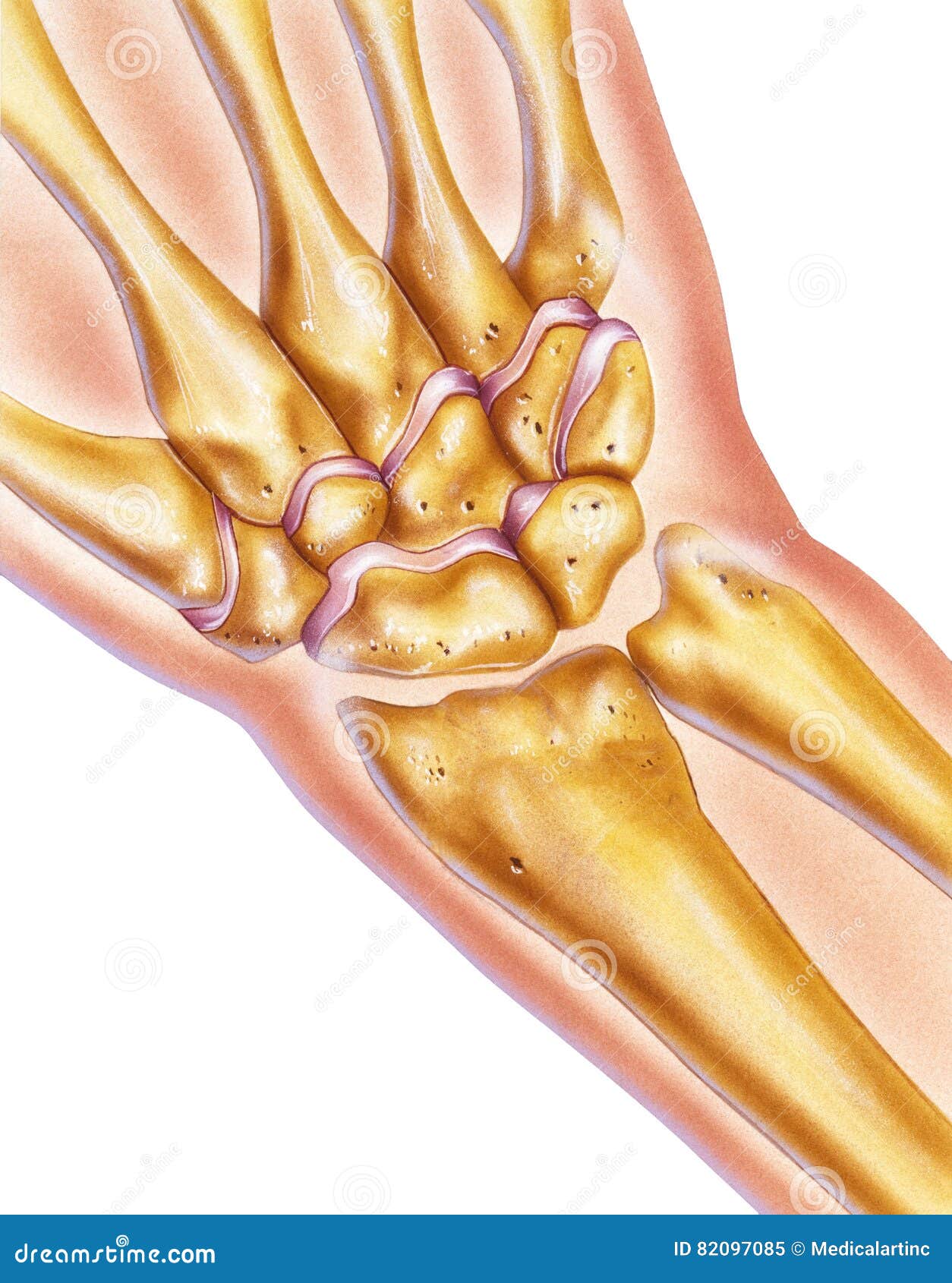 Hand Och Handled - Ben & Skarvar in Situ Stock Illustrationer ...