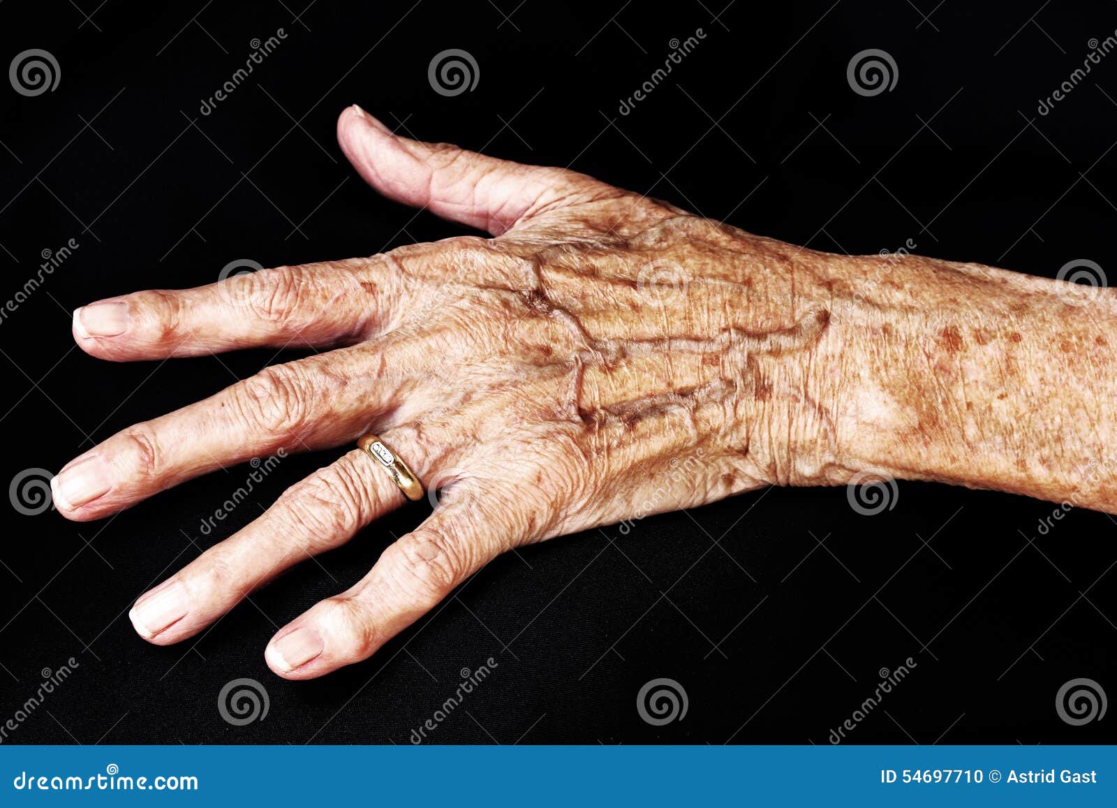 The hand of an old woman stock photo. Image of degenerative - 54697710