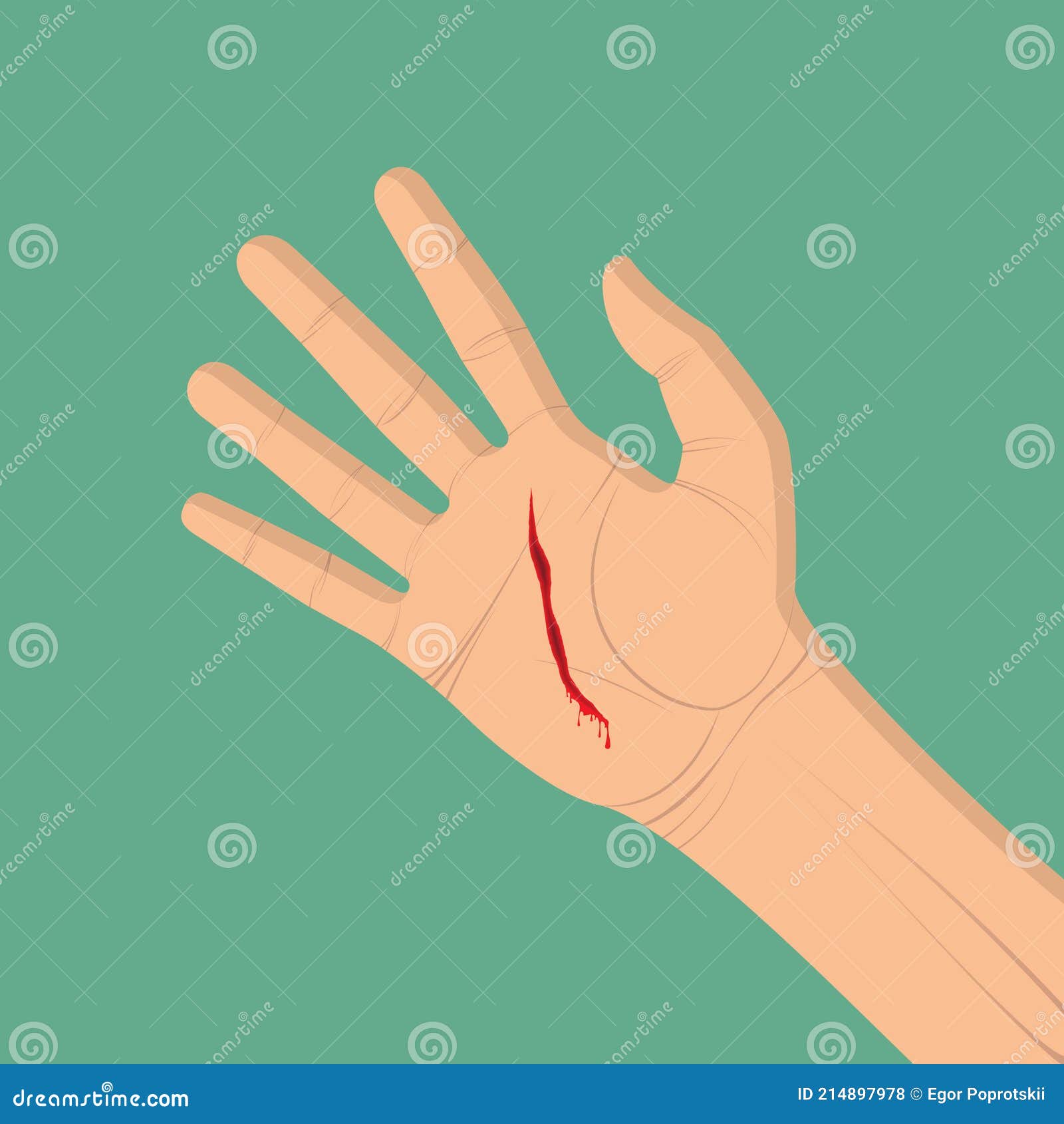 Hand_4 stock vector. Illustration of hospital, wounds - 214897978