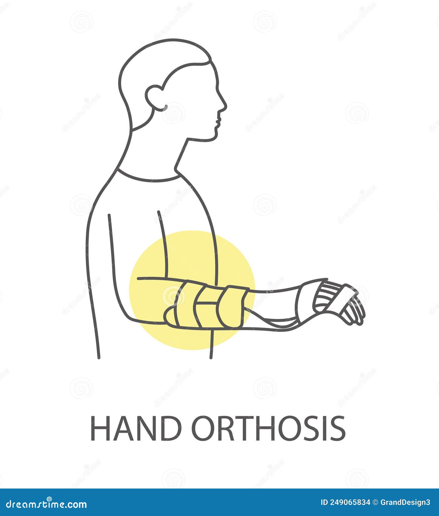 Hand Orthosis Linear Icon, Vector Illustration Stock Vector ...