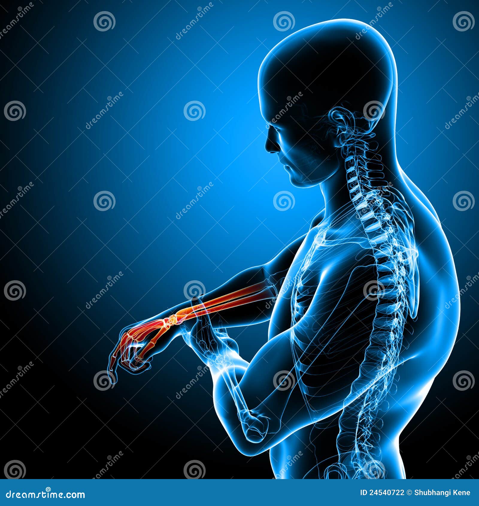 Hand Pain Line And Solid Icon, Officesyndrome Concept, Hand Pain Vector ...