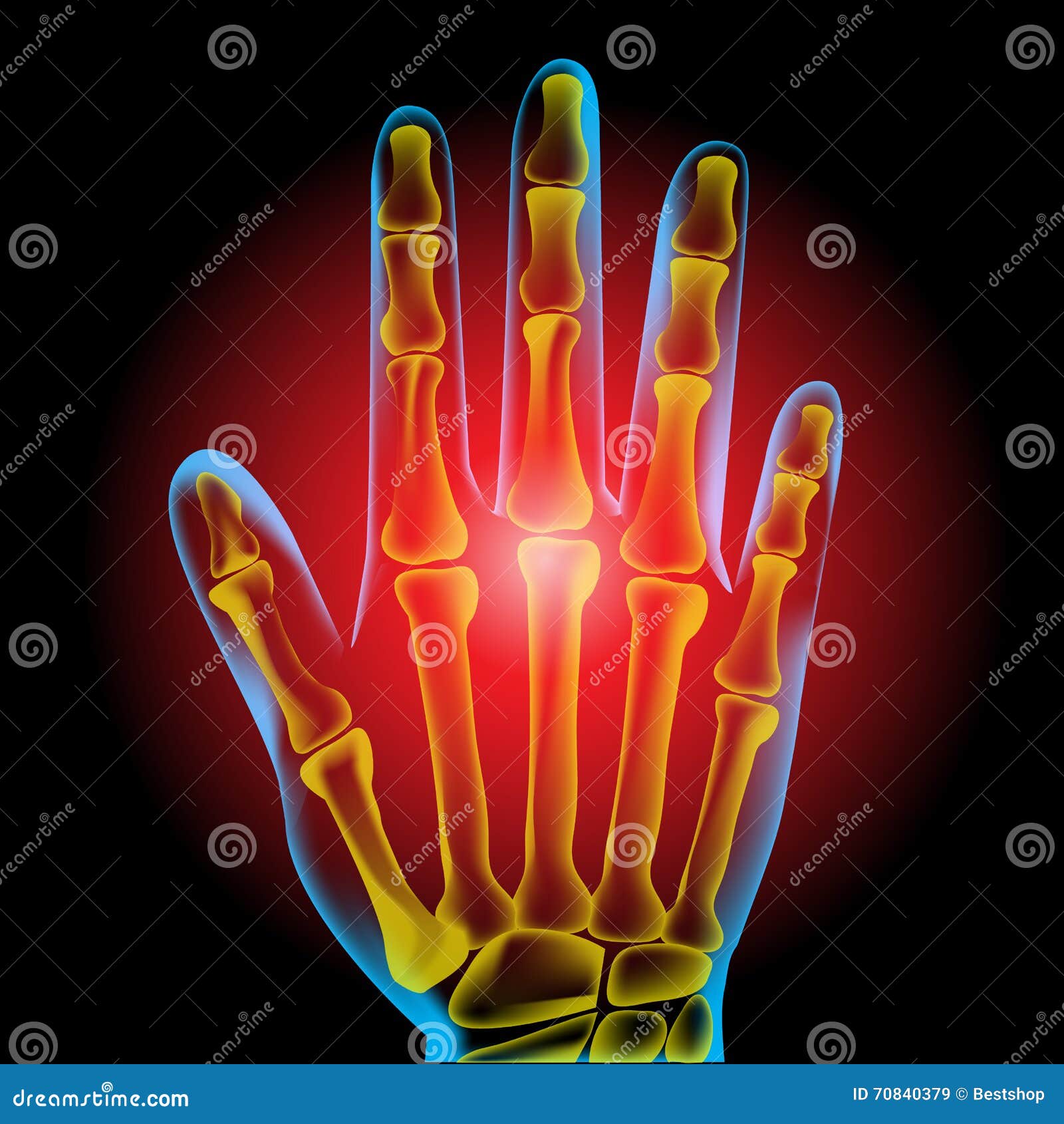 Hand Pain Line And Solid Icon, Officesyndrome Concept, Hand Pain Vector ...