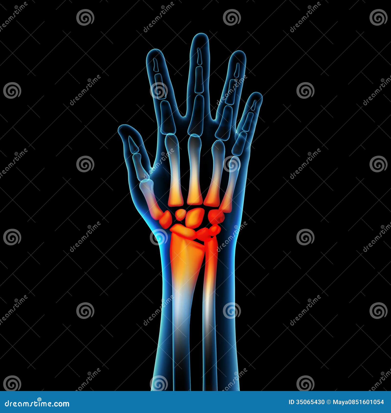 Hand Pain Line And Solid Icon, Officesyndrome Concept, Hand Pain Vector ...