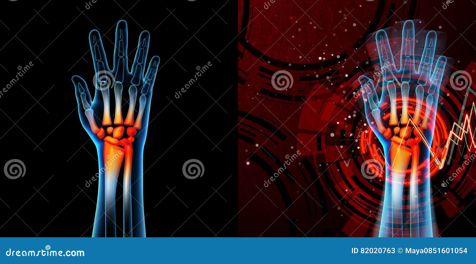 Hand Pain Line And Solid Icon, Officesyndrome Concept, Hand Pain Vector ...