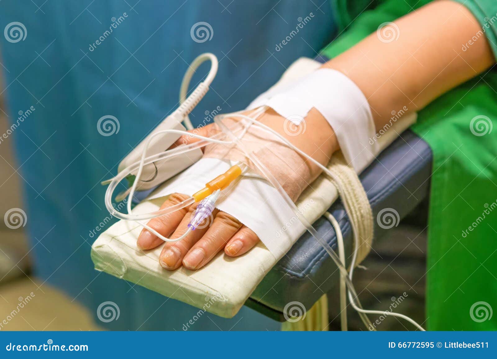 Hand of the Patient in Operation Room Stock Image - Image of disease ...