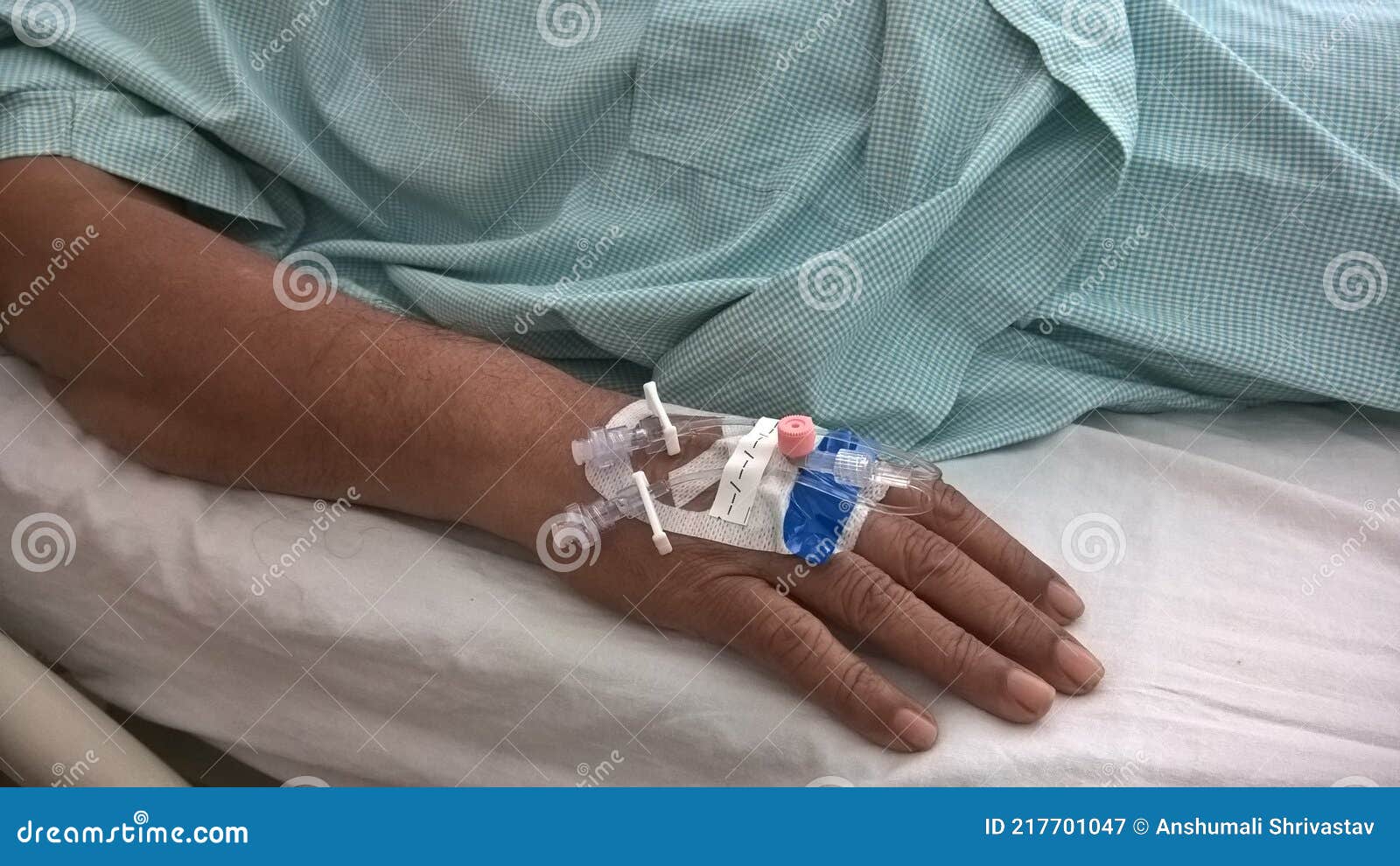 Peripheral Intravenous Catheter In The Vein Of Newborn Baby Foot Stock ...