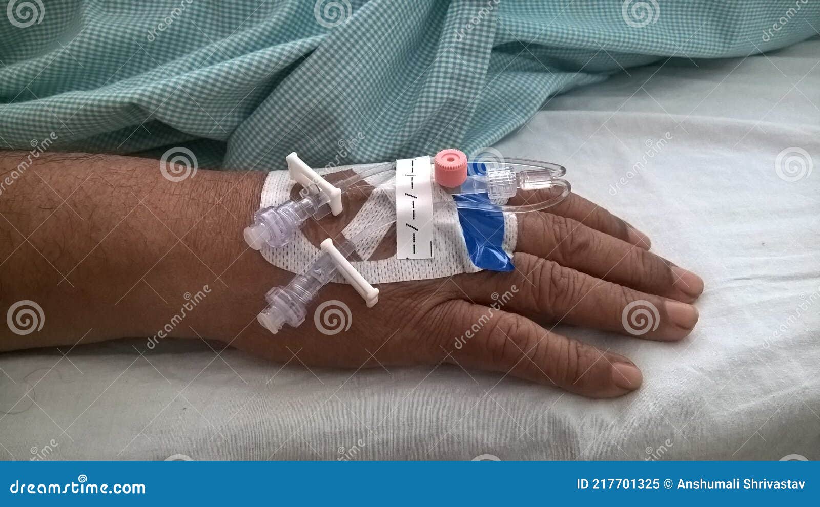 Peripheral Intravenous Catheter In The Vein Of Newborn Baby Foot Stock ...