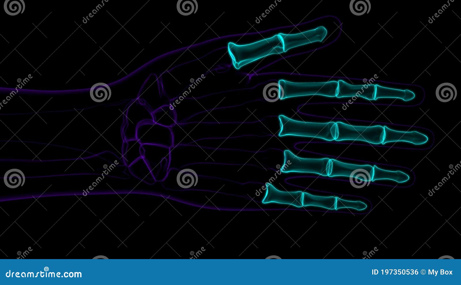 Hand Phalanges Bone Anatomy for Medical Concept Stock Illustrationer ...