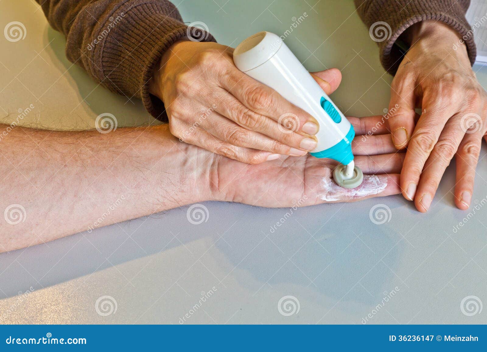 Hand Physiotherapy To Recover a Stock Image - Image of handling ...