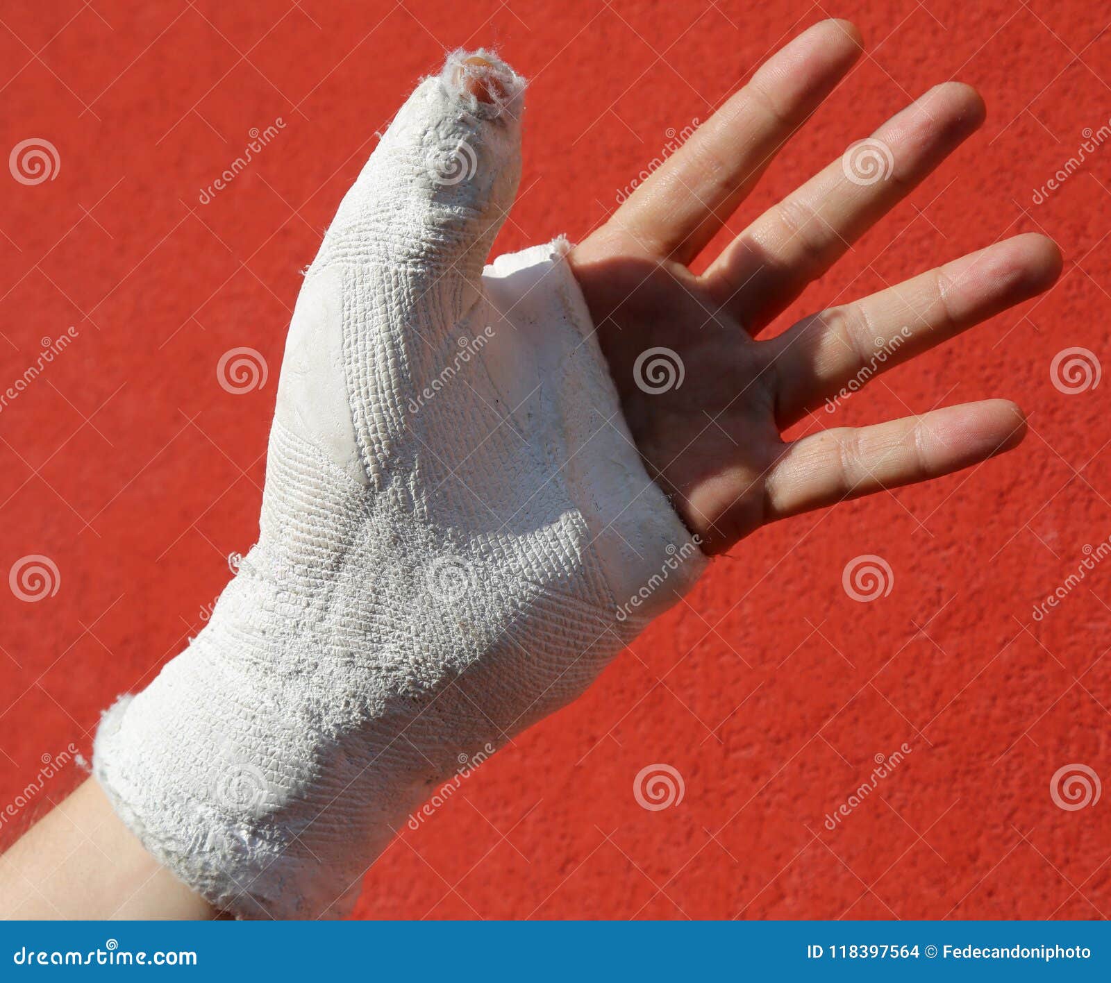 Hand with Plaster on the Red Background Stock Photo - Image of accident ...