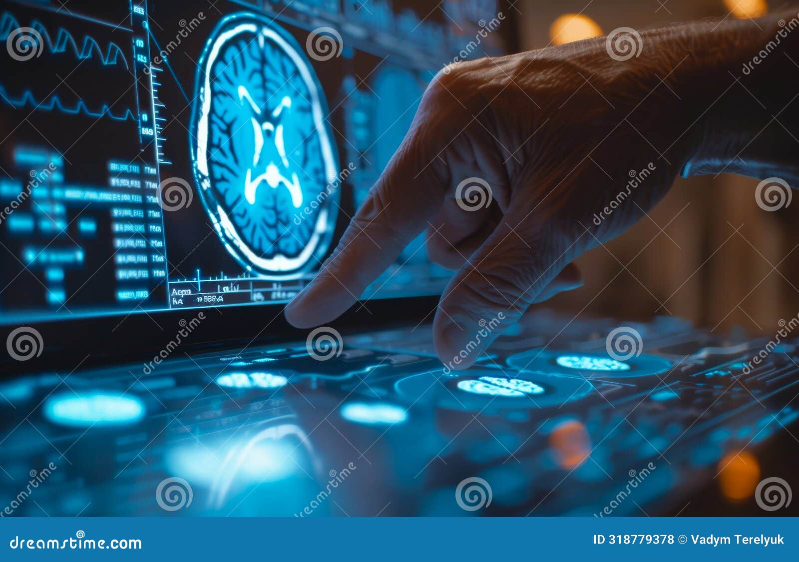 Hand is Pointing at Brain Scan on Screen. Stock Photo - Image of ...