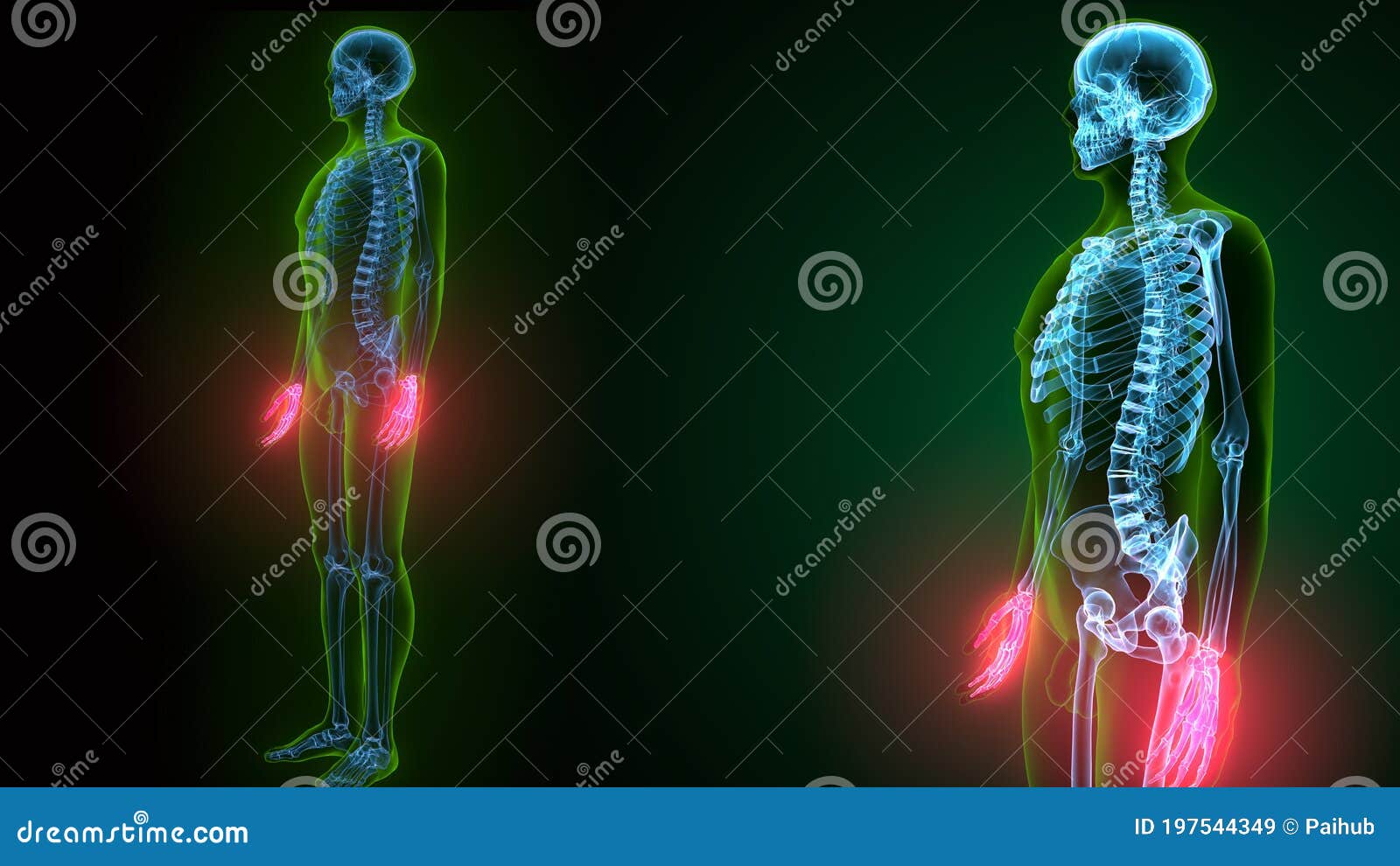3d Render of Human Skeleton Hand Bone Anatomy Stock Illustration ...