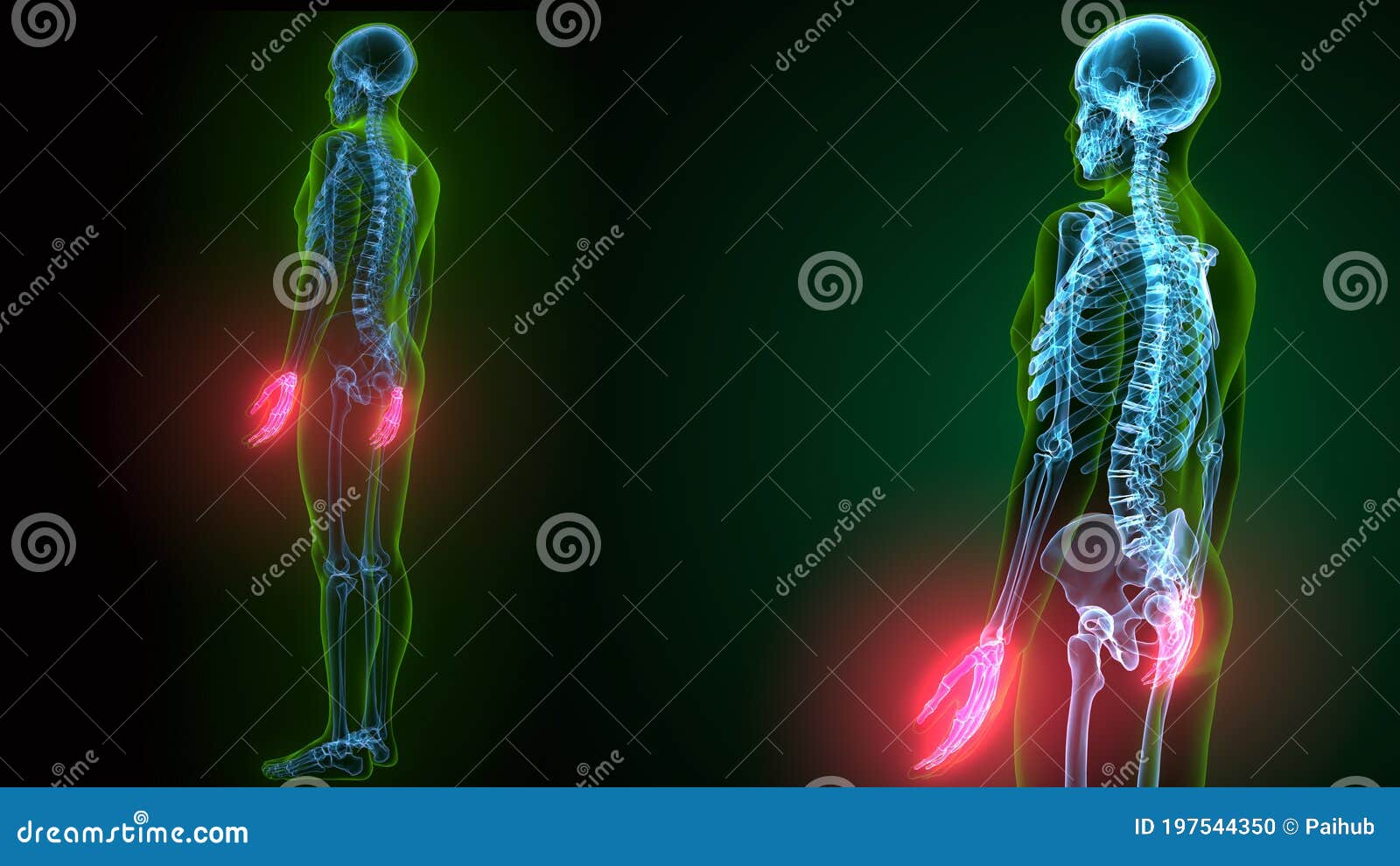 3d Render of Human Skeleton Hand Bone Anatomy Stock Illustration ...