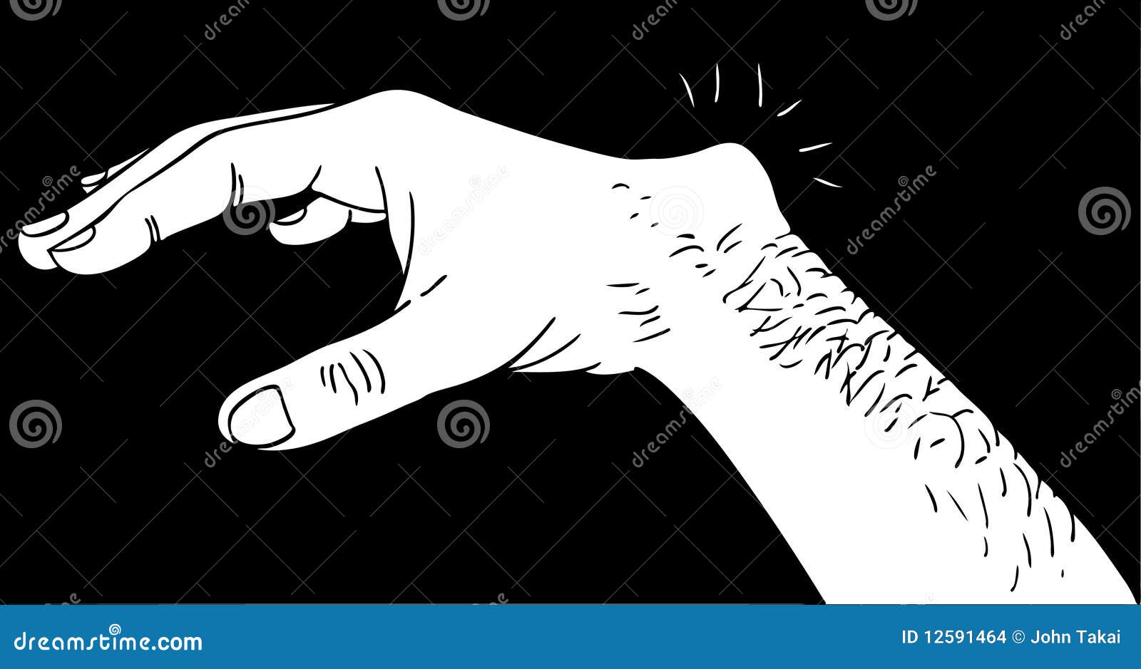 Hand Problem stock vector. Illustration of condition - 12591464