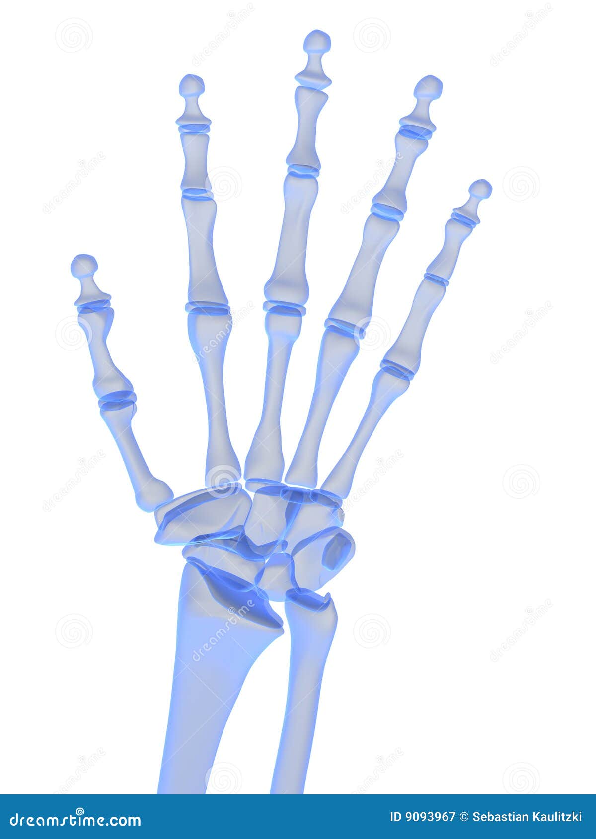 Hand x-ray stock illustration. Illustration of phalanx - 9093967