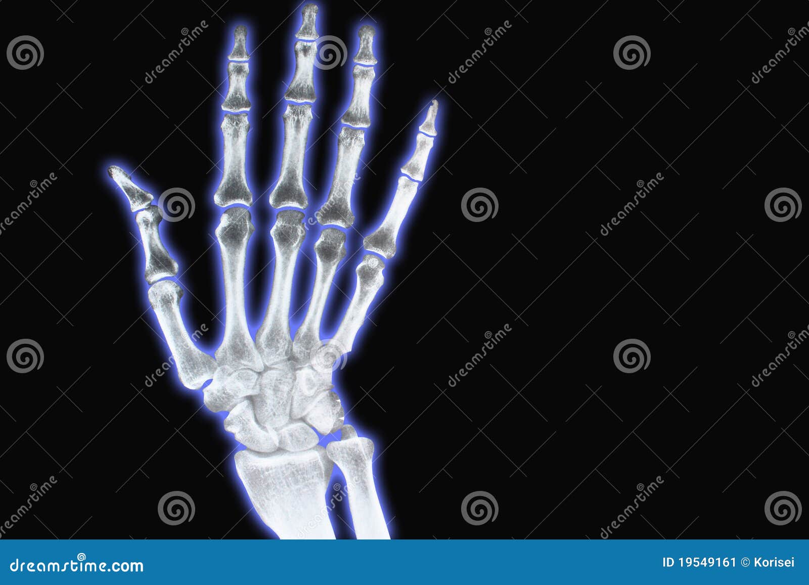 Hand x-ray with blue stock image. Image of anatomy, body - 19549161