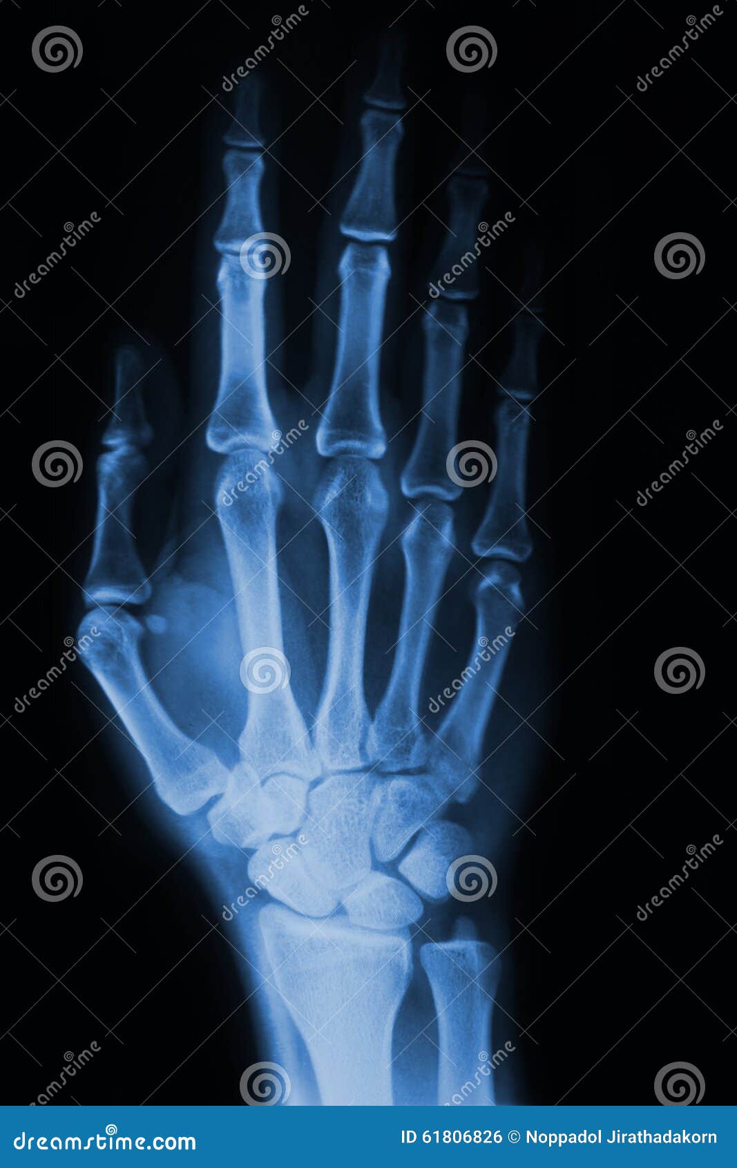 Hand x-ray stock photo. Image of light, transparent, angle - 61806826