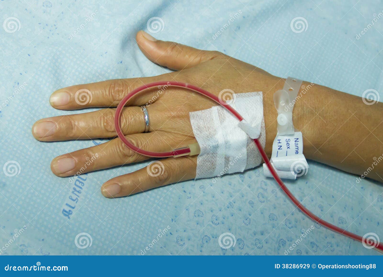 Hand with Saline Intravenous Stock Image - Image of woman, healthy ...