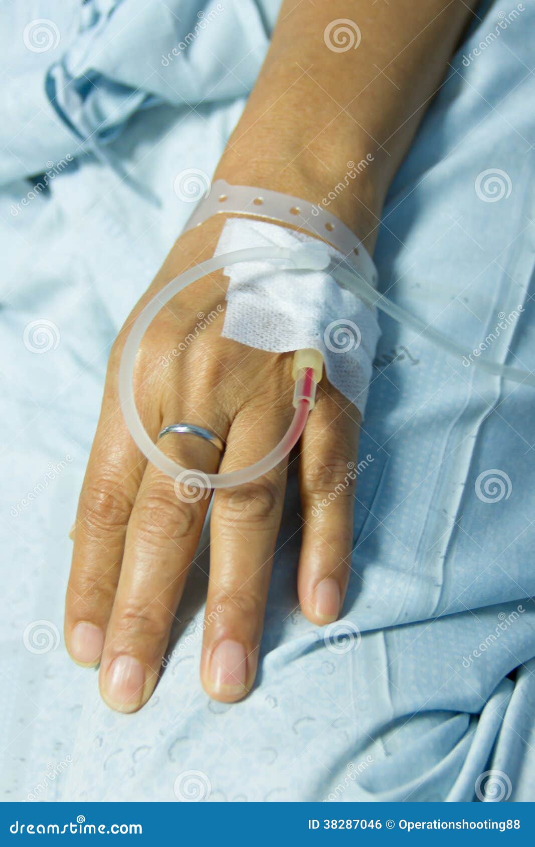 Hand with Saline Intravenous Stock Photo - Image of intravenous, care ...