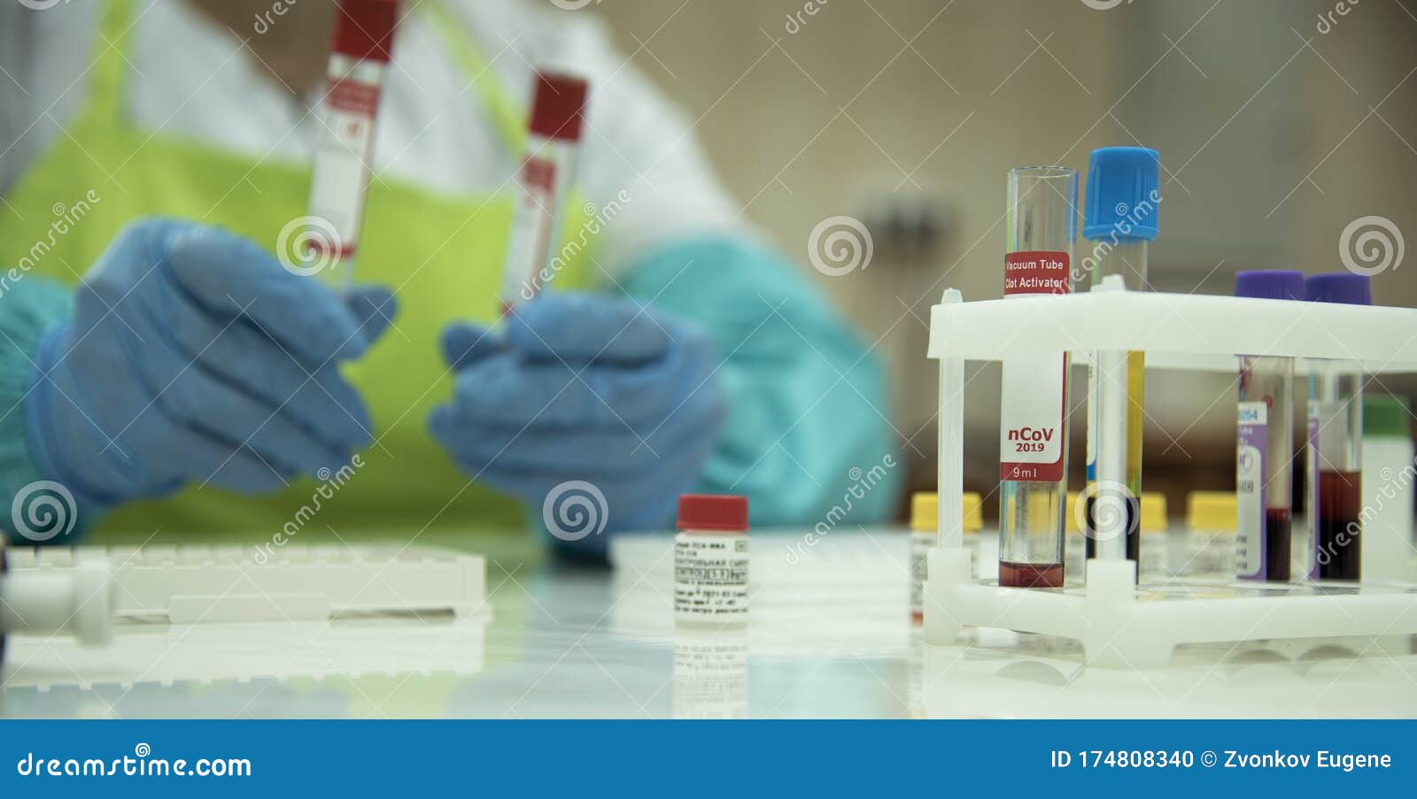 Hand of a Scientific Taking a Blood Sample Tube Hand Holding a Tube ...