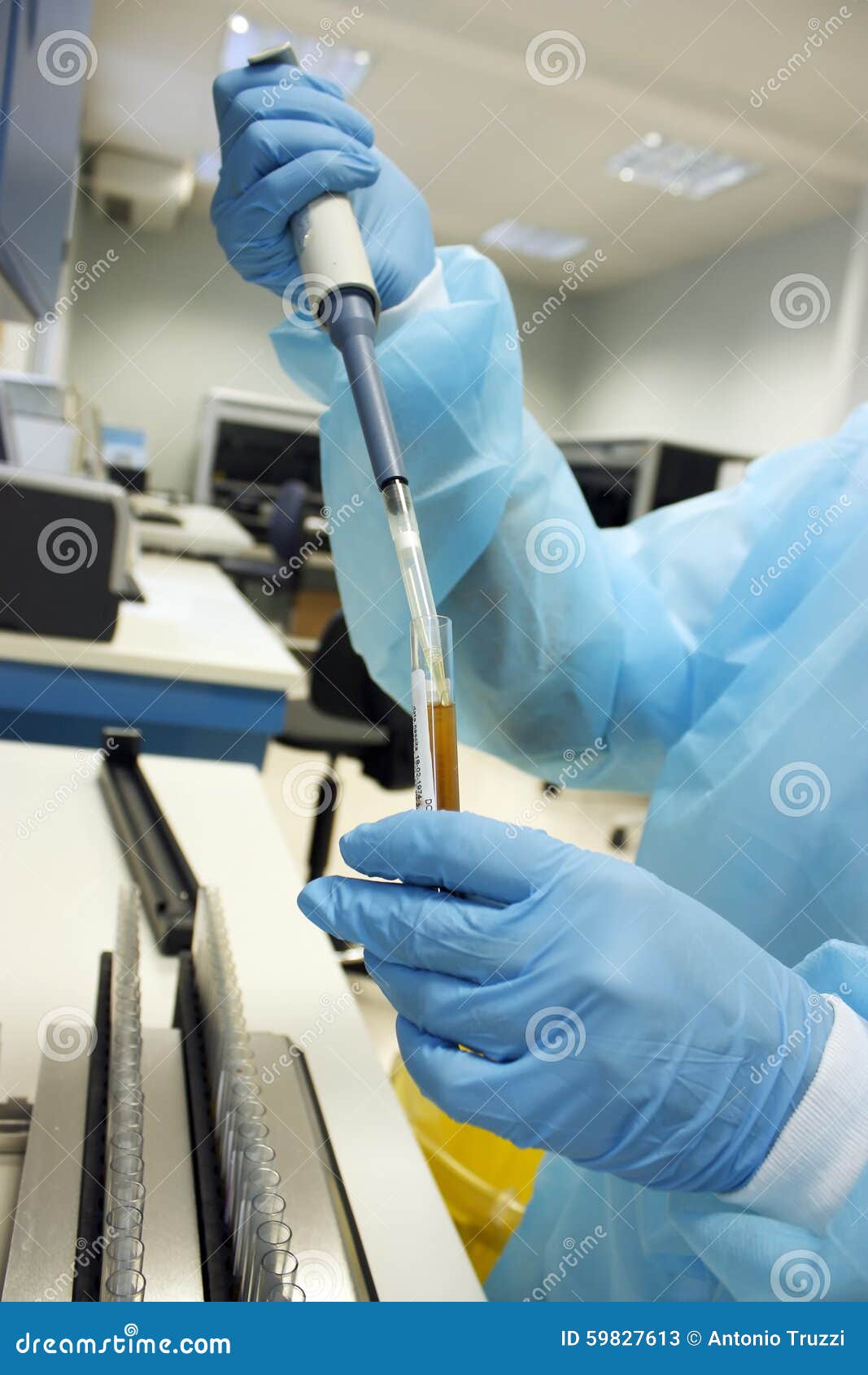 Hand with Test Tube of Blood and Pipe Stock Image - Image of analysis ...