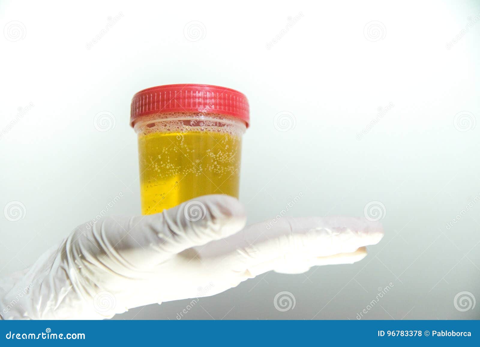 Urine Container With Code Bar In Blue Background Royalty-Free Stock ...