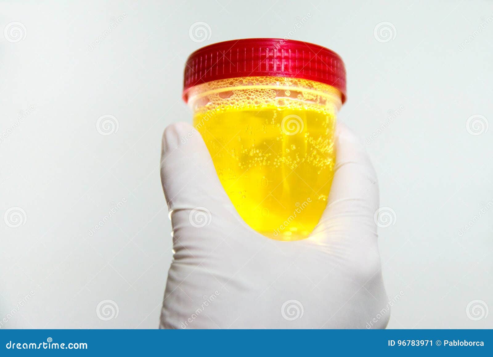 Urine Container With Code Bar In Blue Background Royalty-Free Stock ...