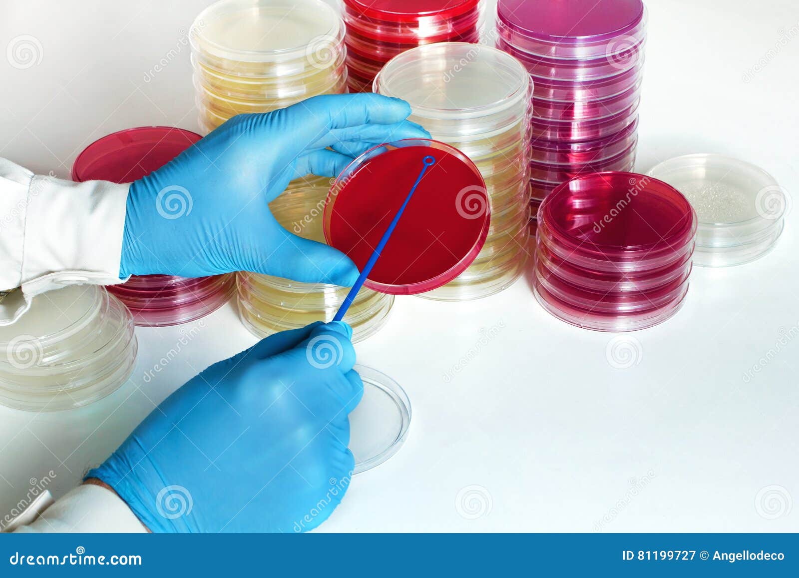 Hand Von Doktor Eine Urinkultur in Einer Petrischale Machend Stockbild ...