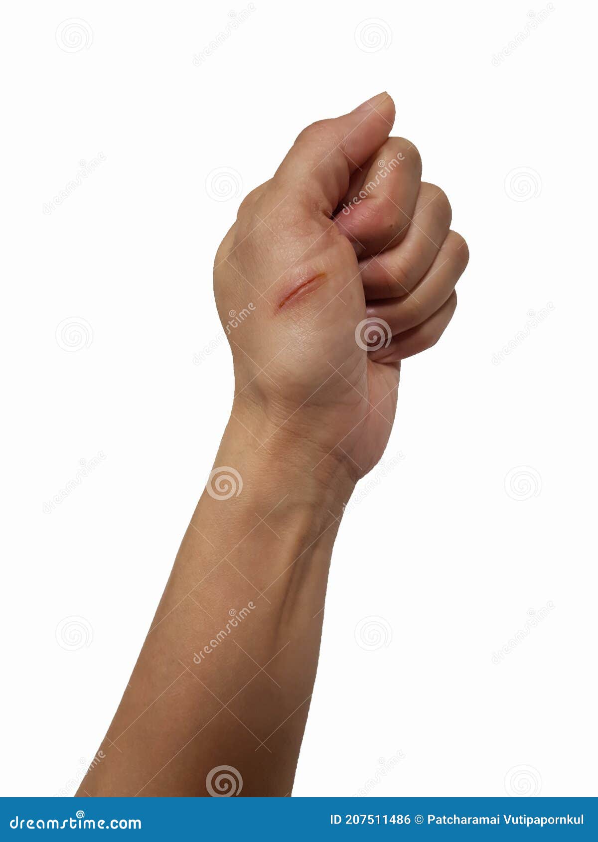 The Hand Was Wounded by a Knife. on a White Background Stock Photo ...