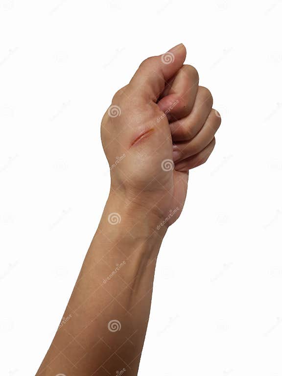 The Hand Was Wounded by a Knife. on a White Background Stock Photo ...