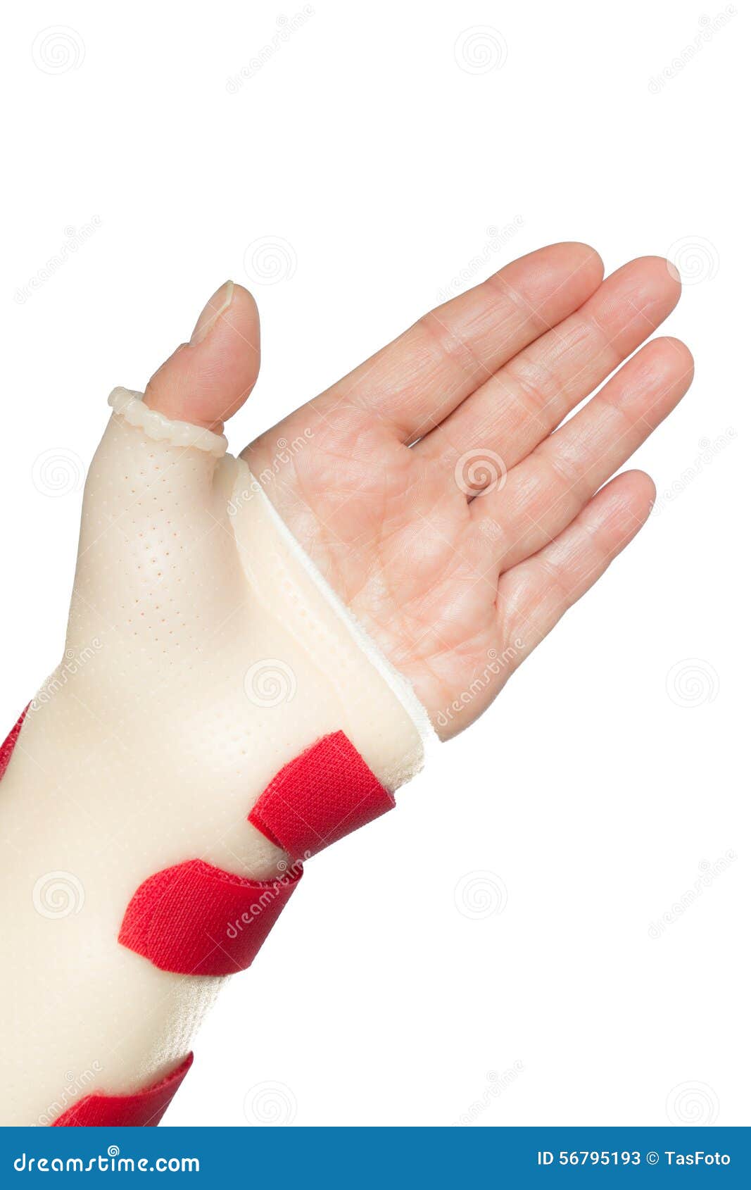 Hand With Wrist And Thumb Splint Royalty-Free Stock Photo ...