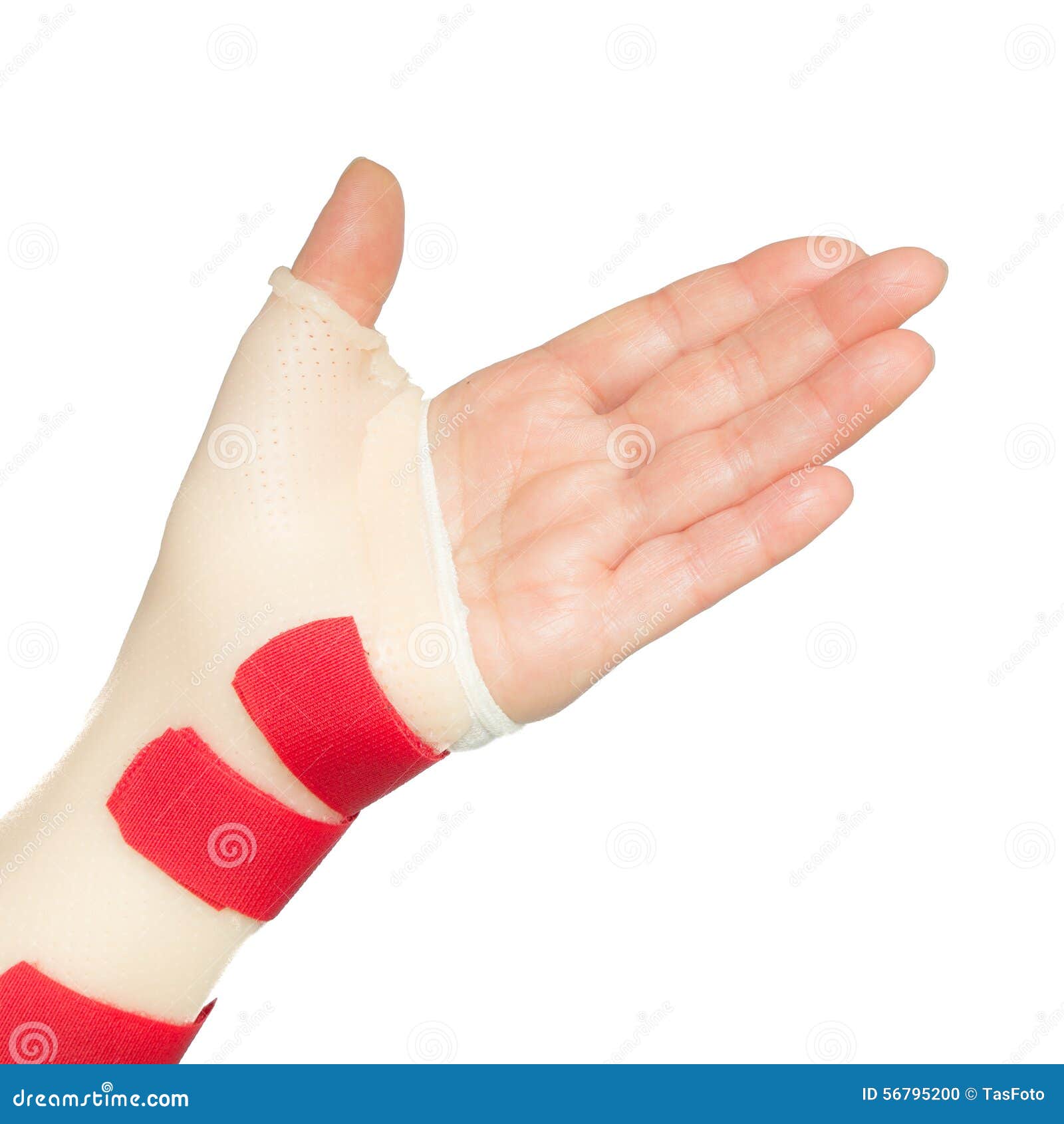 Hand With Wrist And Thumb Splint Royalty-Free Stock Image ...