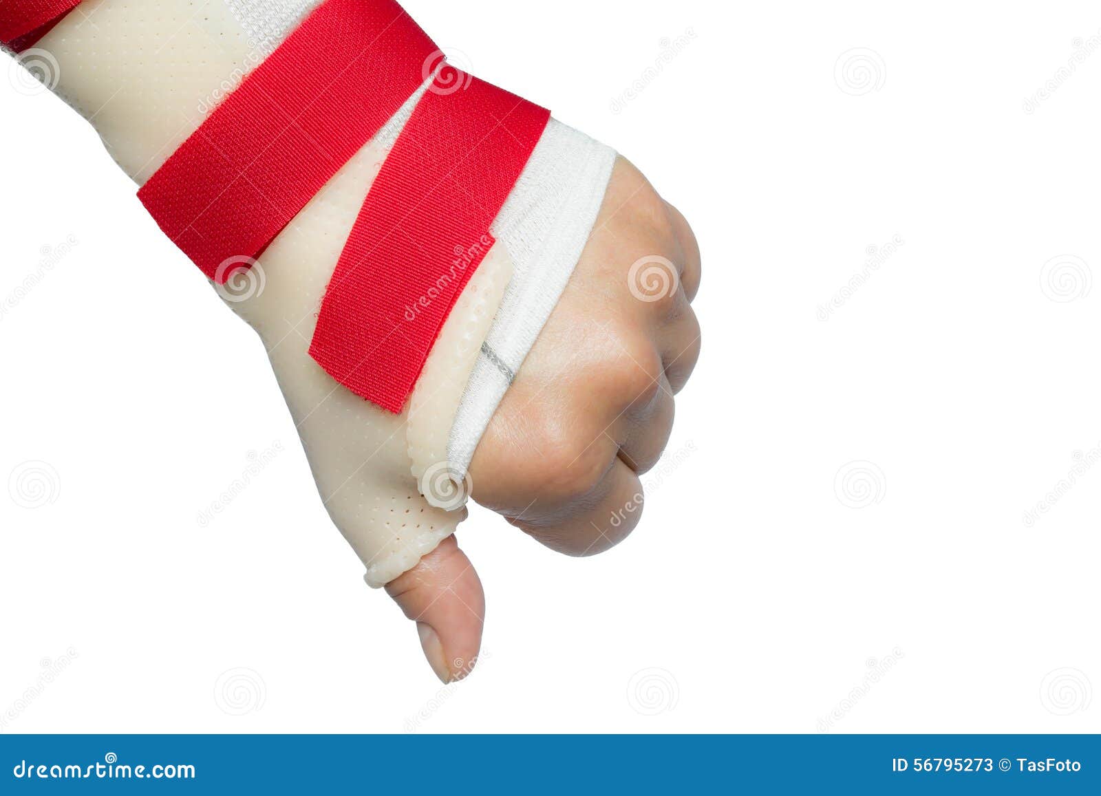 Hand With Wrist And Thumb Splint Royalty-Free Stock Photography ...