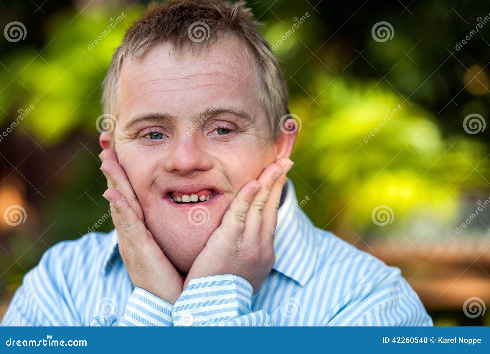 Handicapped Boy with Hands on Face. Stock Photo - Image of ...