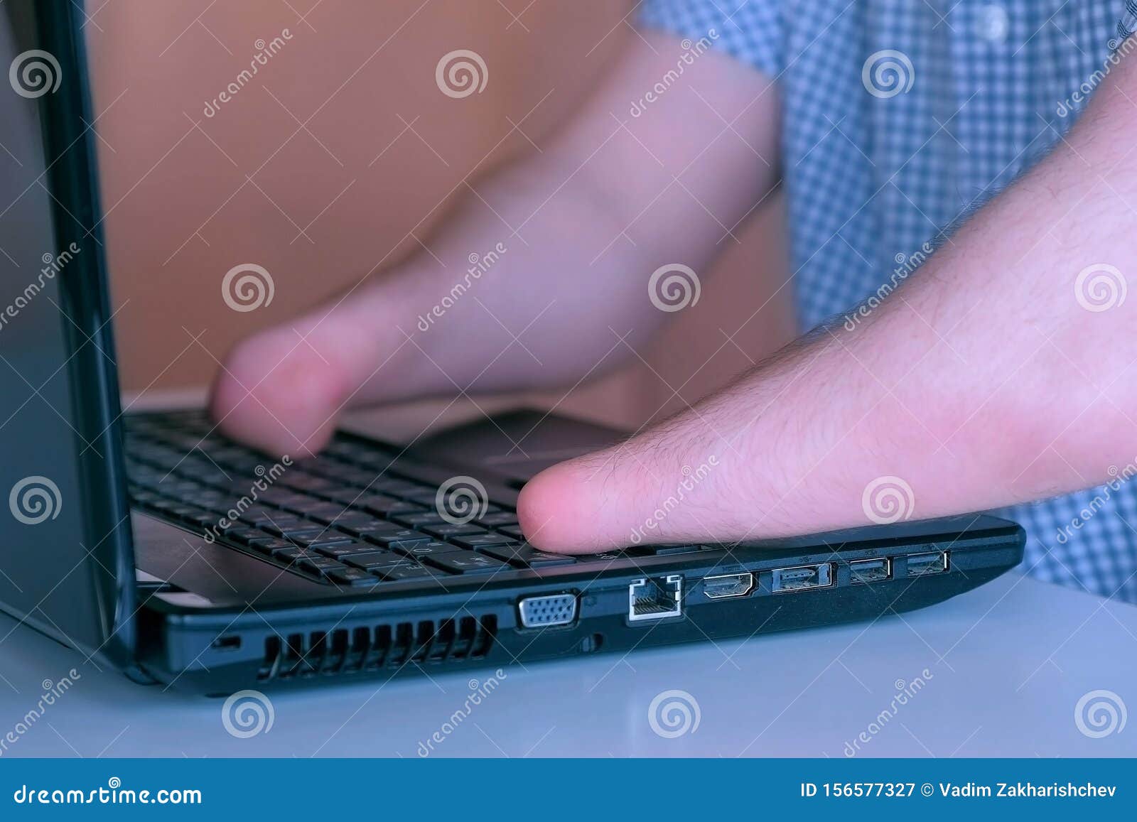 Disabled Man with Amputated Two Stump Hands is Typing on Laptop ...