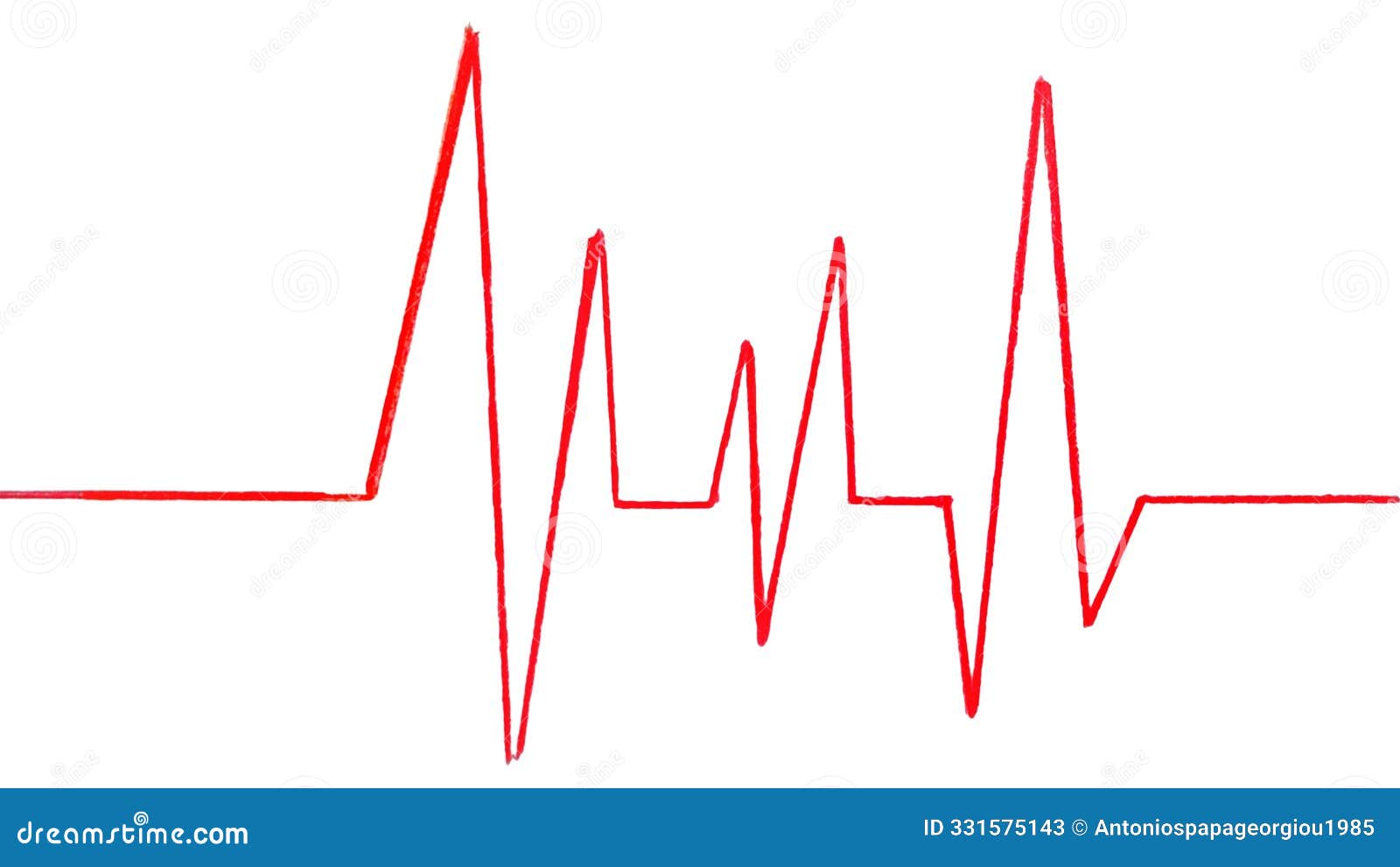A Handmade Drawing of a Cardiogram. Stock Illustration - Illustration ...