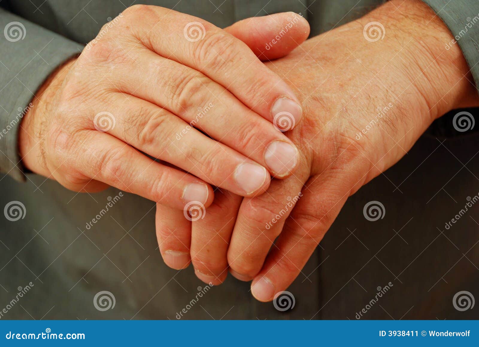 Hands that are Chapped stock image. Image of fingernails - 3938411