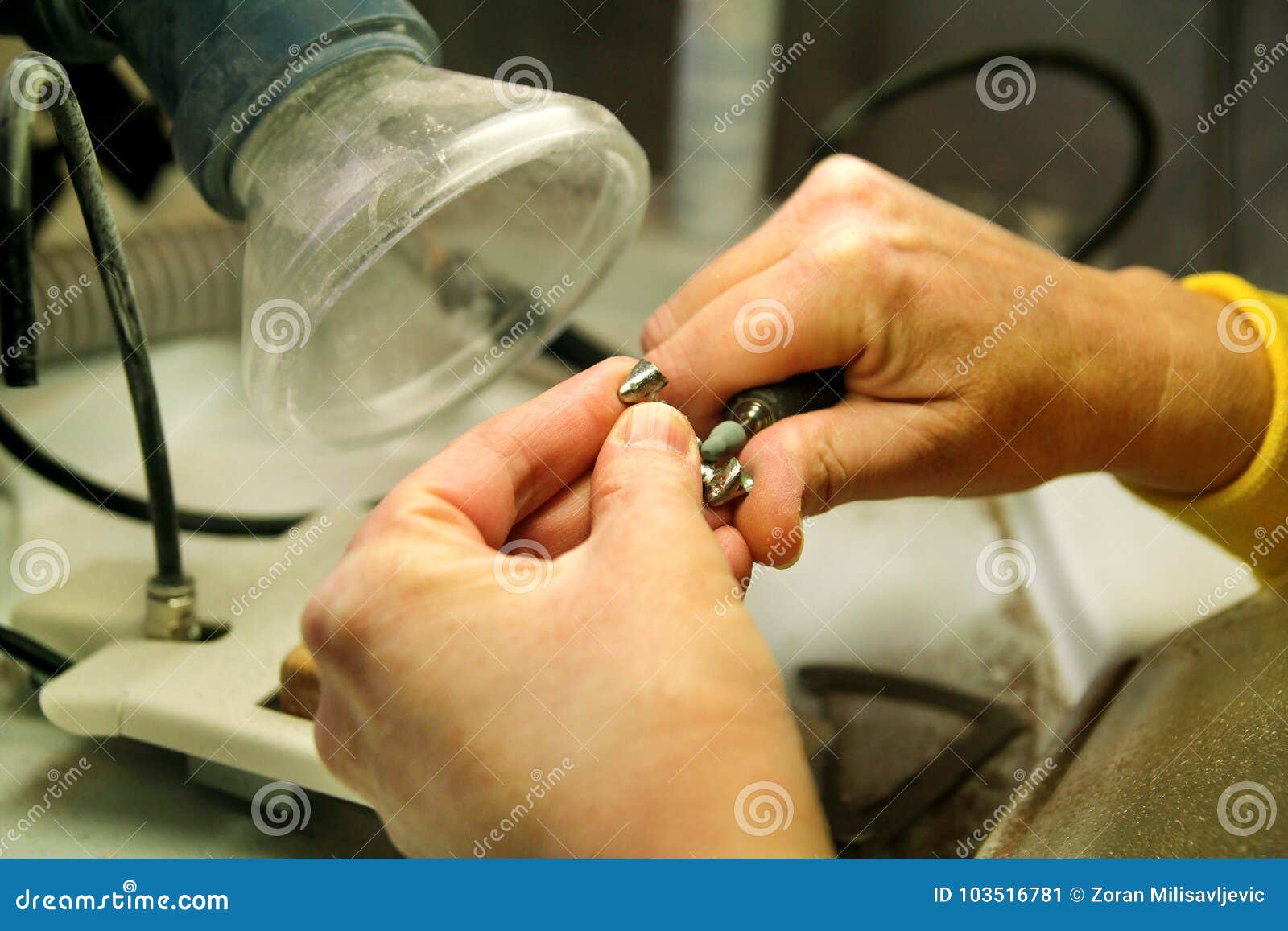 Hands of Dental Technician Processing Metal Oral Prosthesis Stock Image ...