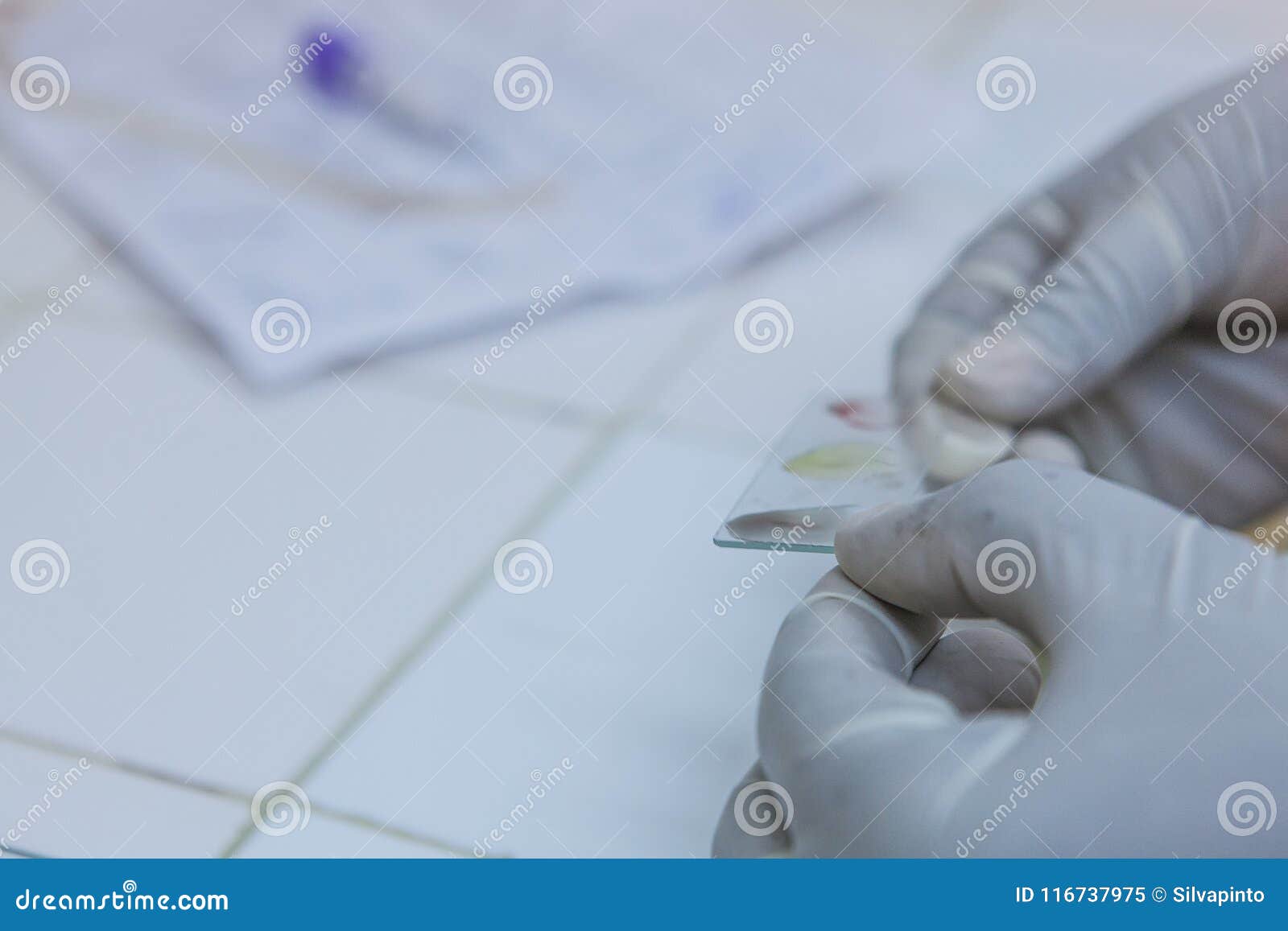 Hands of Doctor Holding Blood Test Plates. Stock Image - Image of ...