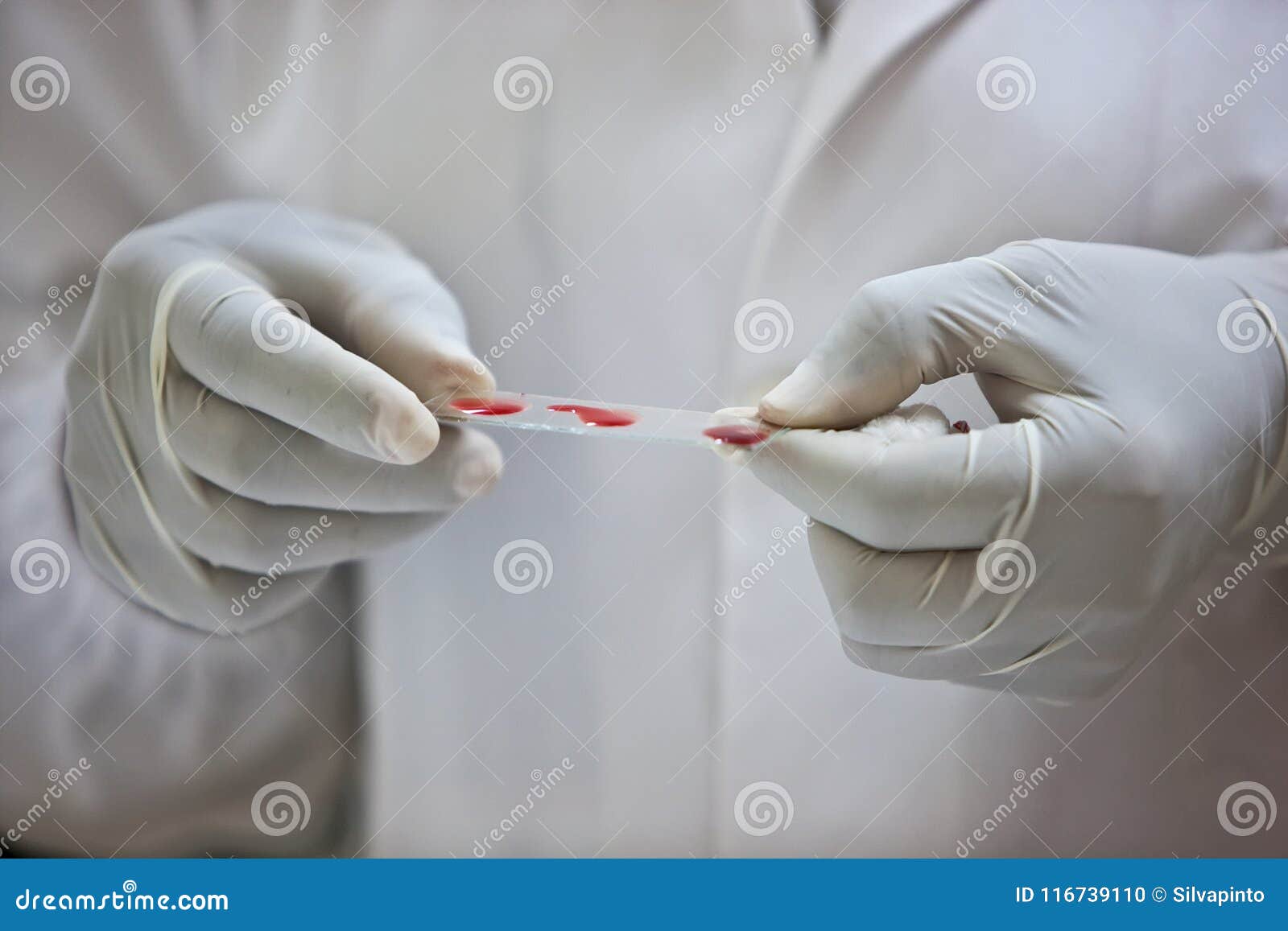 Hands of Doctor Holding Blood Test Plates. Stock Photo - Image of ...