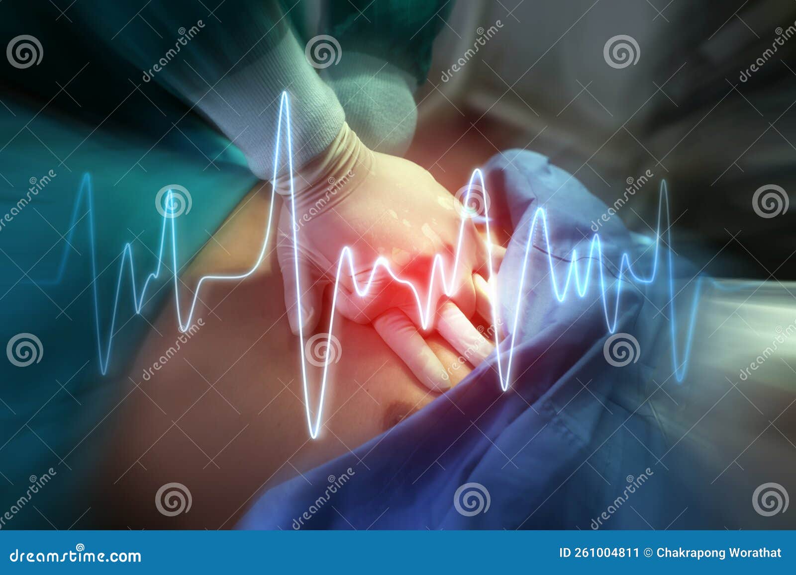Hands of Doctor Perform CPR on a Patient in Opertion Room Stock Image ...