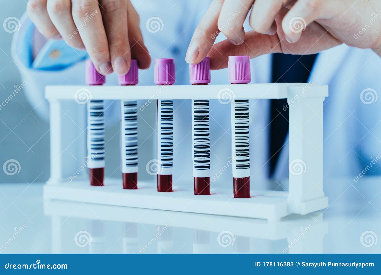 Hands of a Lab Technician with Blood Test Sample Tubes in a Row for ...