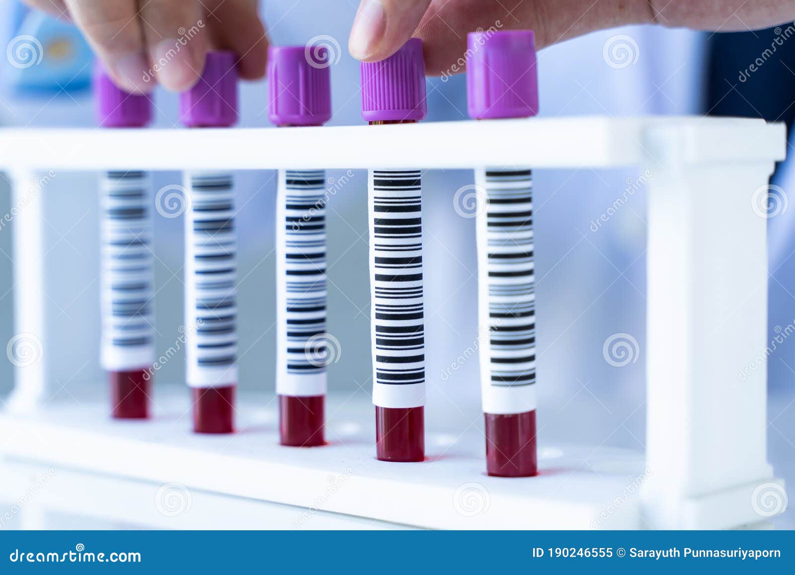 Hands of a Lab Technician with Blood Test Sample Tubes in a Row for ...