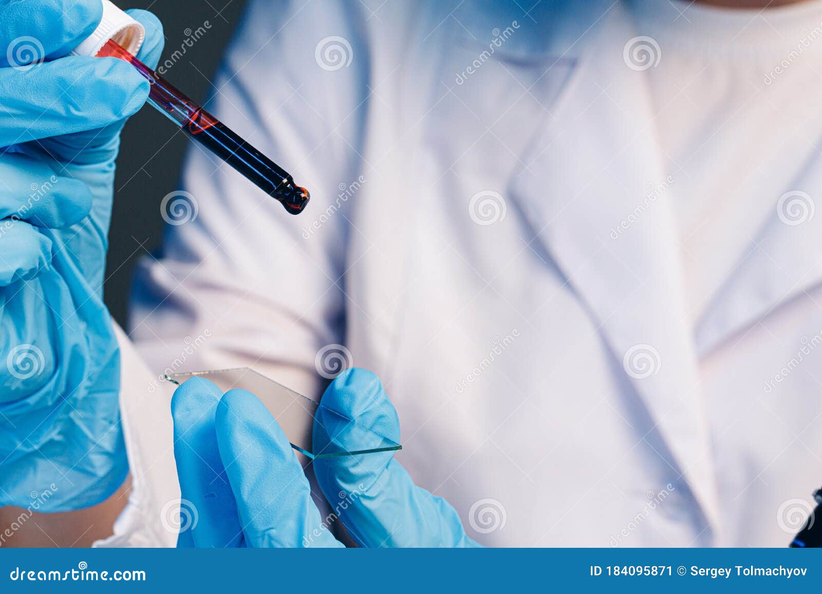 Hands of a Laboratory Worker Doing Blood Test Stock Image - Image of ...