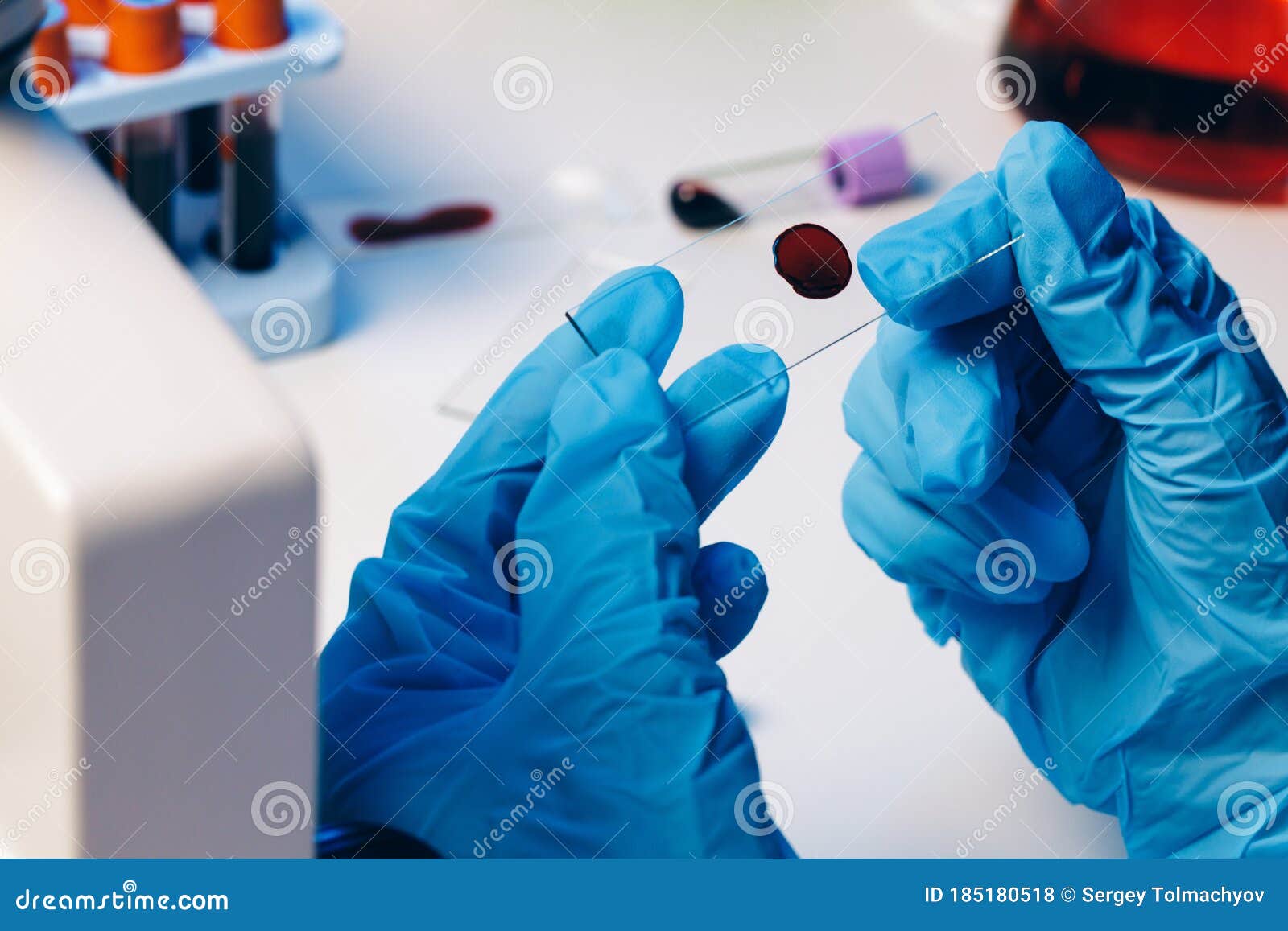 Hands of a Laboratory Worker Doing Blood Test Stock Photo - Image of ...