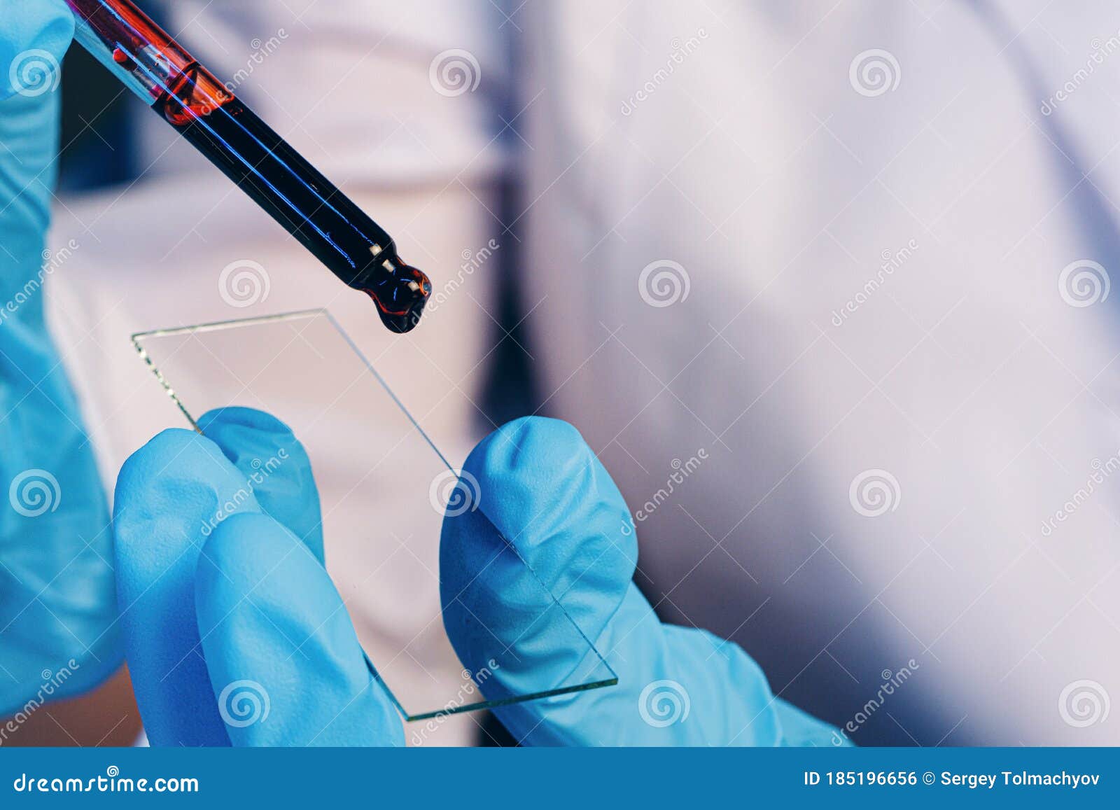 Hands of a Laboratory Worker Doing Blood Test Stock Photo - Image of ...