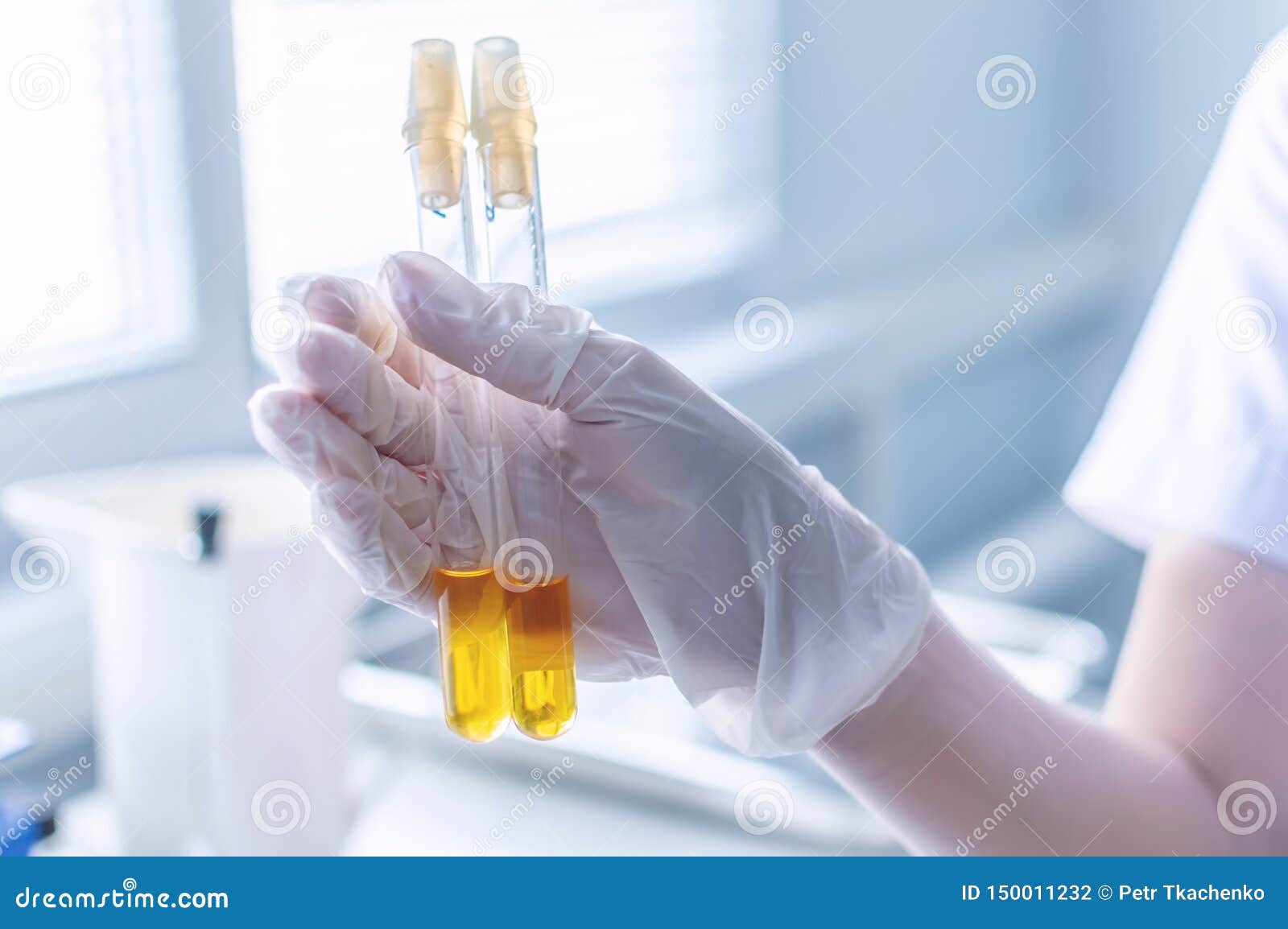 Hands with Microscope in the Laboratory Stock Photo - Image of health ...